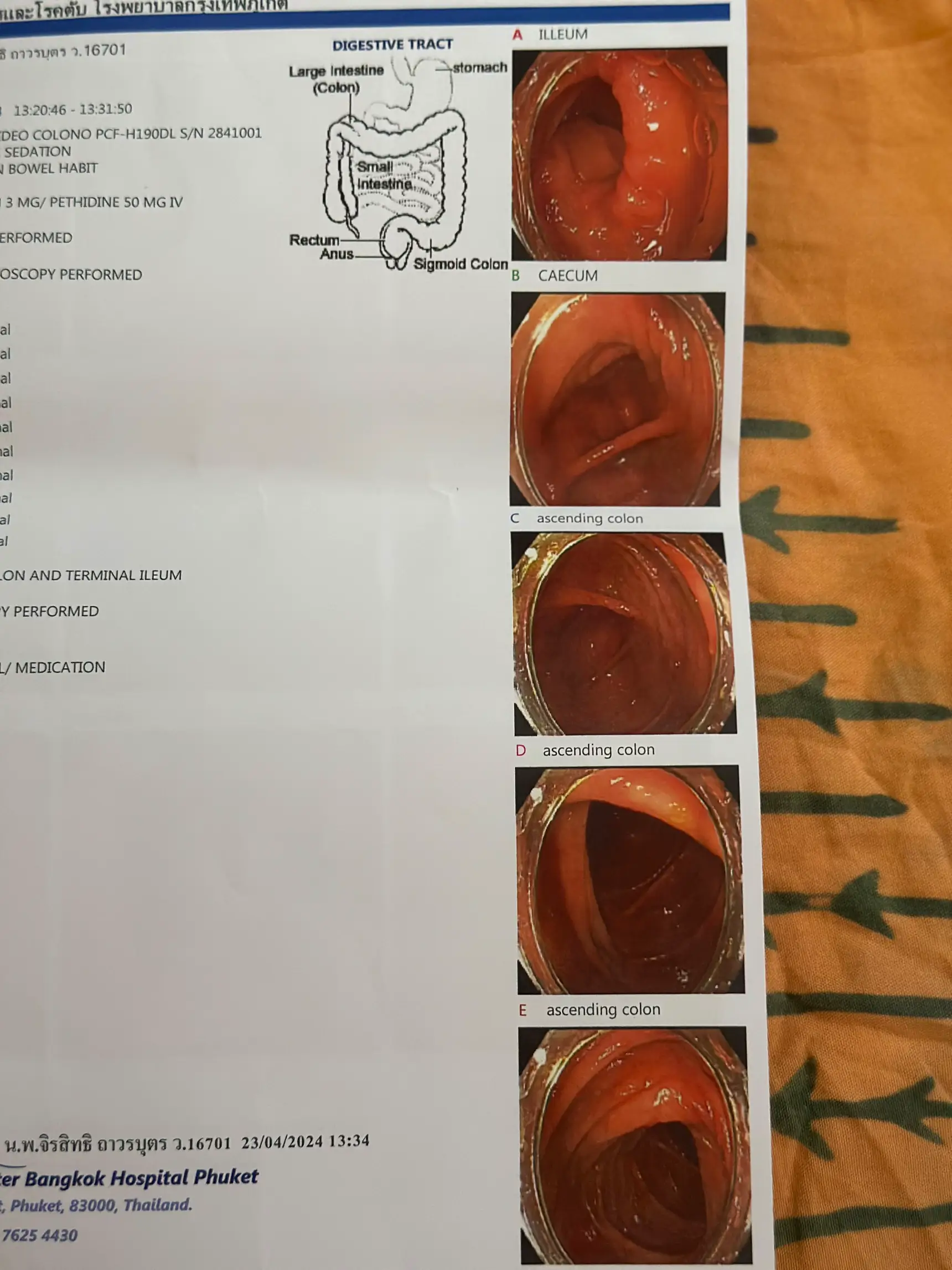 แชร์ประสบการณ์“ส่องกล้องลำไส้ใหญ่” | แกลเลอรีที่โพสต์โดย Chanida🐸🐸Aom🏝🌤 ...