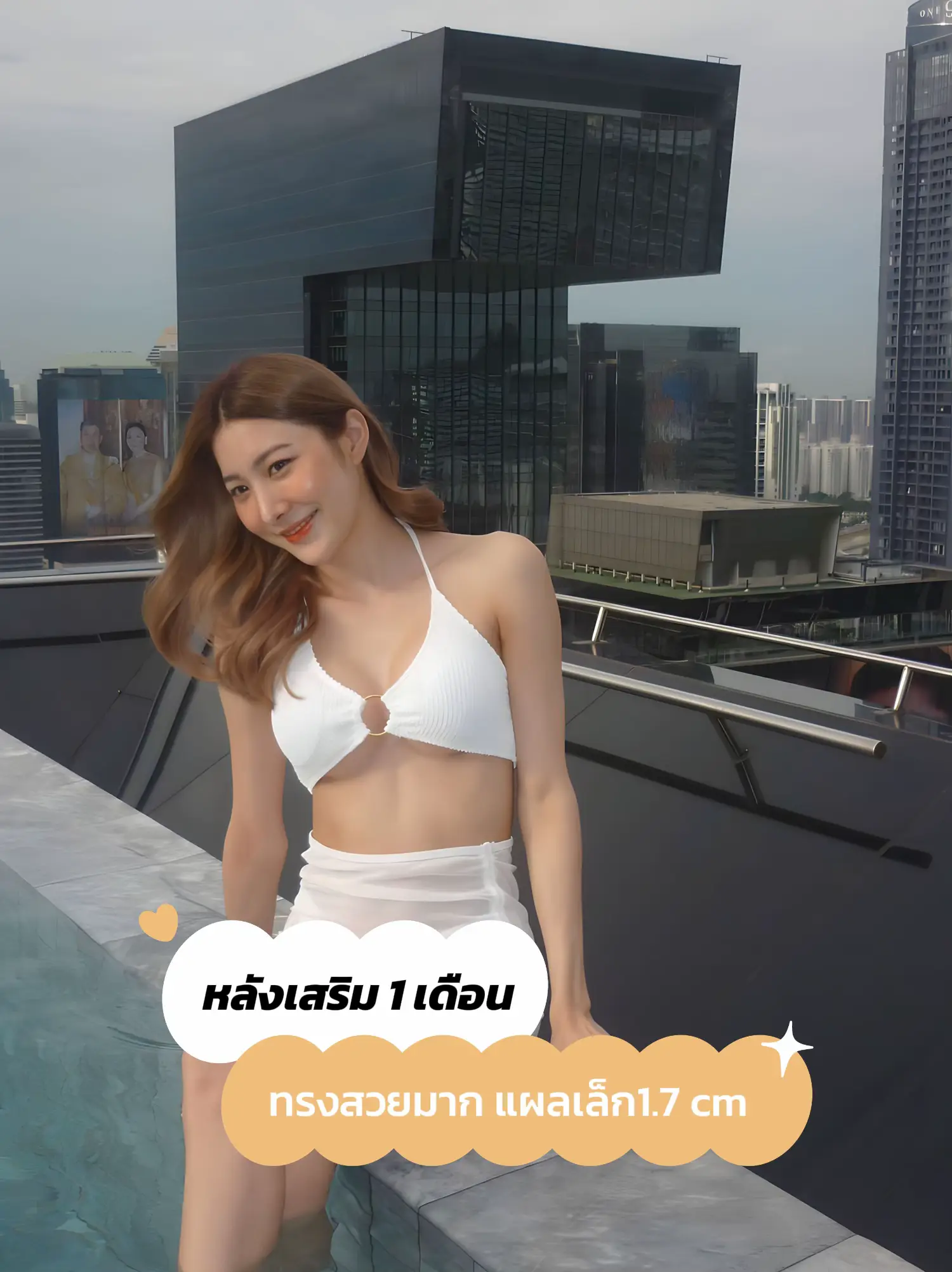 เสริมหน้าอกครั้งแรกปังหรือพัง 🍼 | แกลเลอรีที่โพสต์โดย Jutha | Lemon8