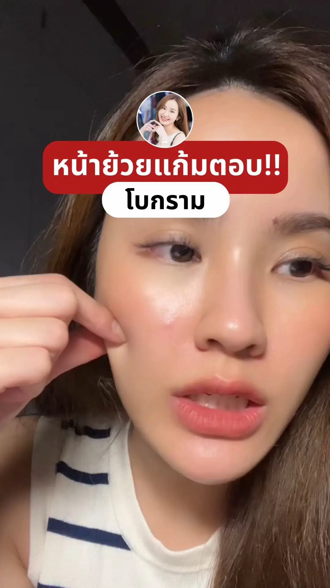 หน้าย้วย&แก้มตอบ หลังโบกราม | วิดีโอที่เผยแพร่โดย Thewika T. | Lemon8