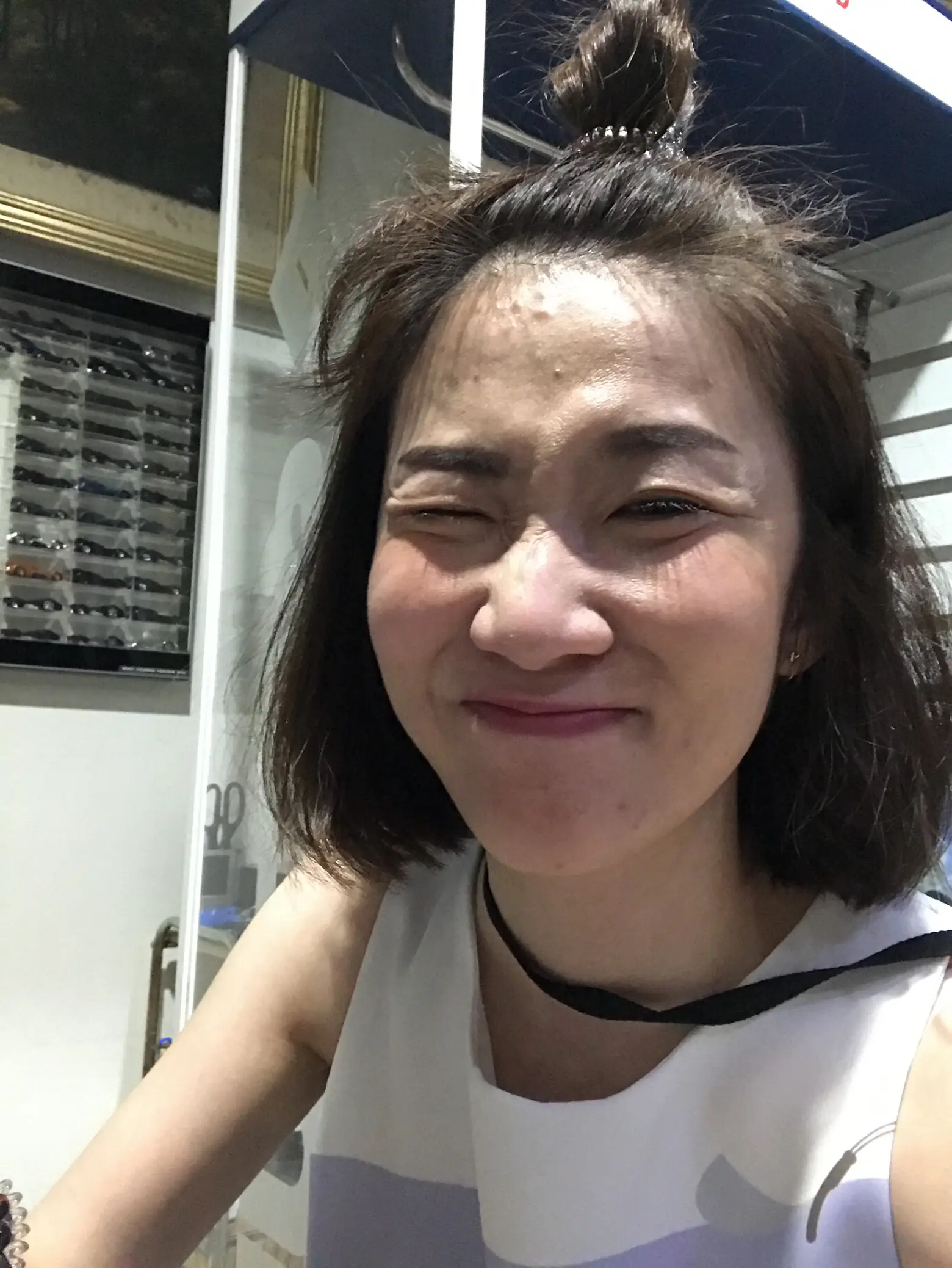 กู้ผิวสิวสู่ผิวสวย ทำไงบ้าง มาดูกัน | แกลเลอรีที่โพสต์โดย Yumi | Lemon8