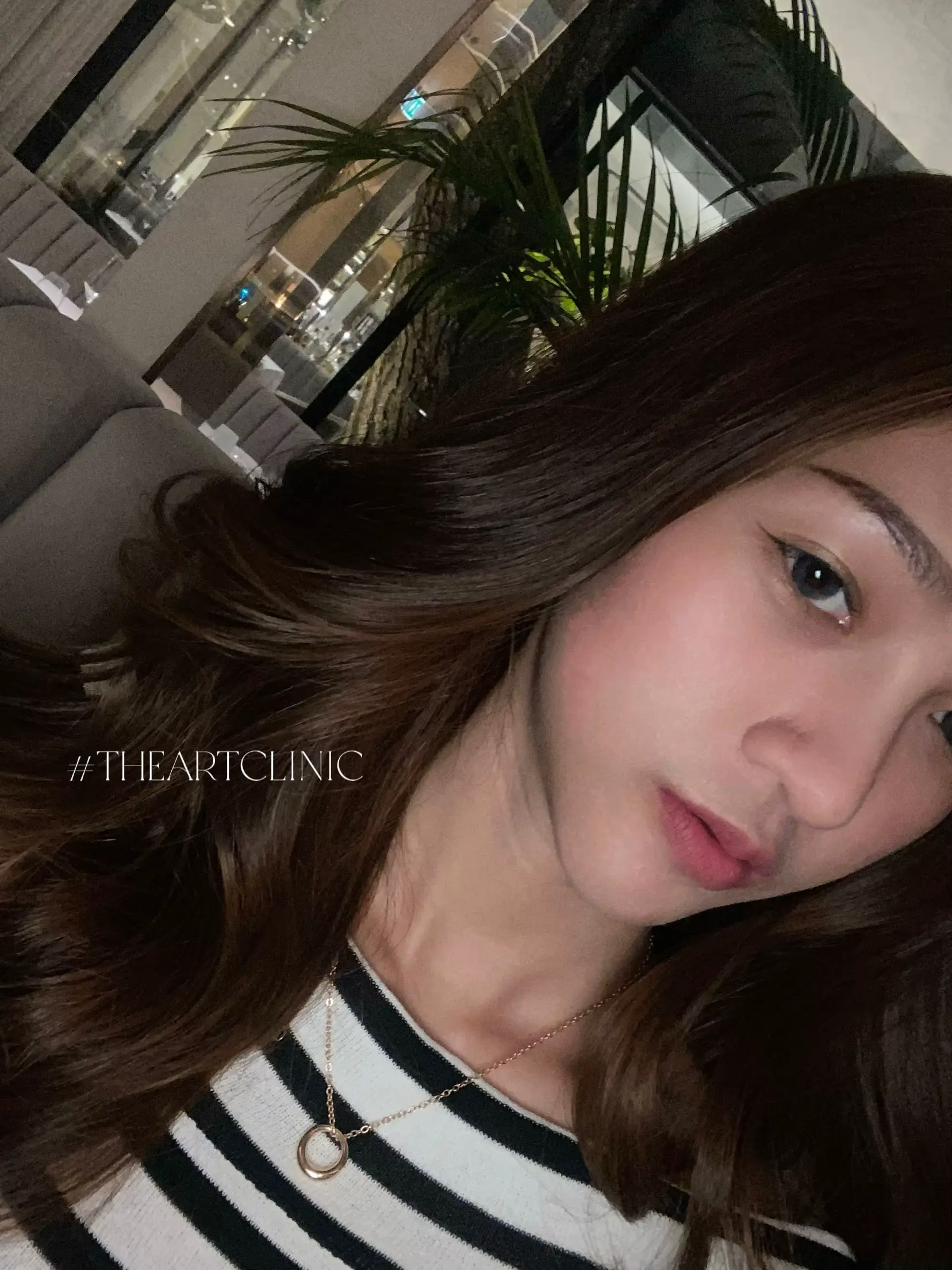 ครบ1เดือนแล้วค่าา Theartclinic🎉💗 | แกลเลอรีที่โพสต์โดย Mintny | Lemon8