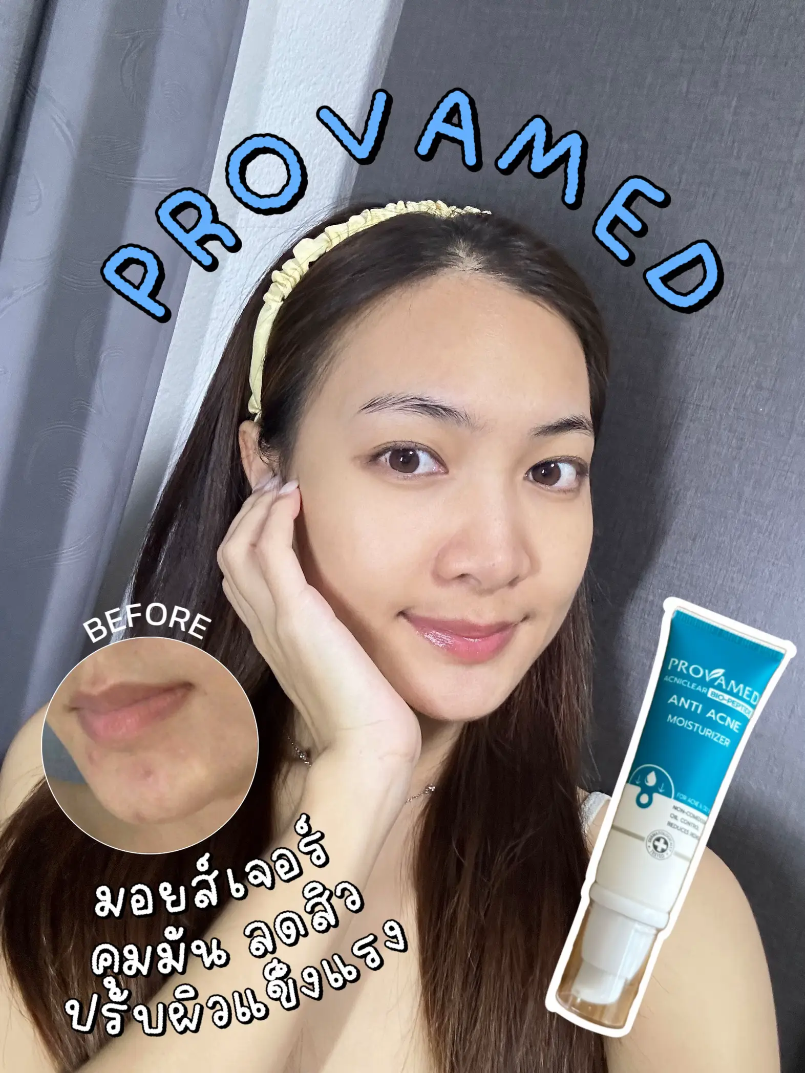 มอยส์เจอไรเซอร์ คุมมัน ลดสิว ปรับผิวแข็งแรง Provamed🪞🧼 | แกลเลอรีที่โพสต์โดย nudda | Lemon8
