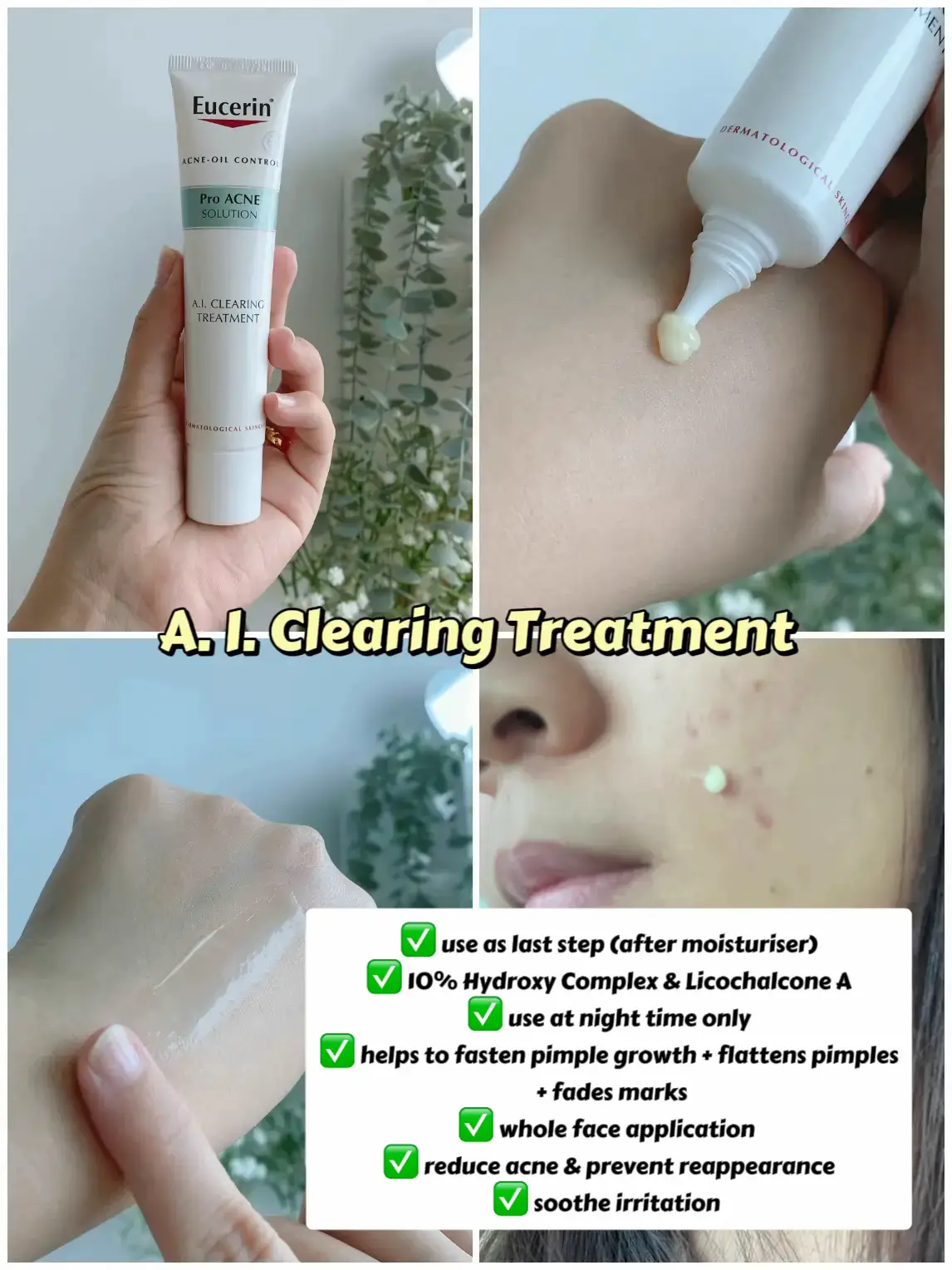 How I fade Acne Marks in 2 weeks 💪🏻 | Galeri disiarkan oleh Karen 🦭 ...