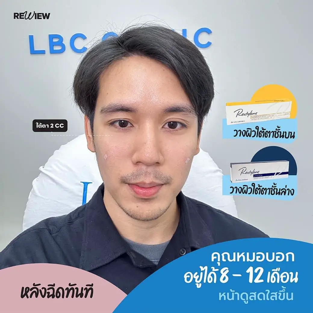 รีวิวฉีดใต้ตา Lbc - การค้นหาใน Lemon8