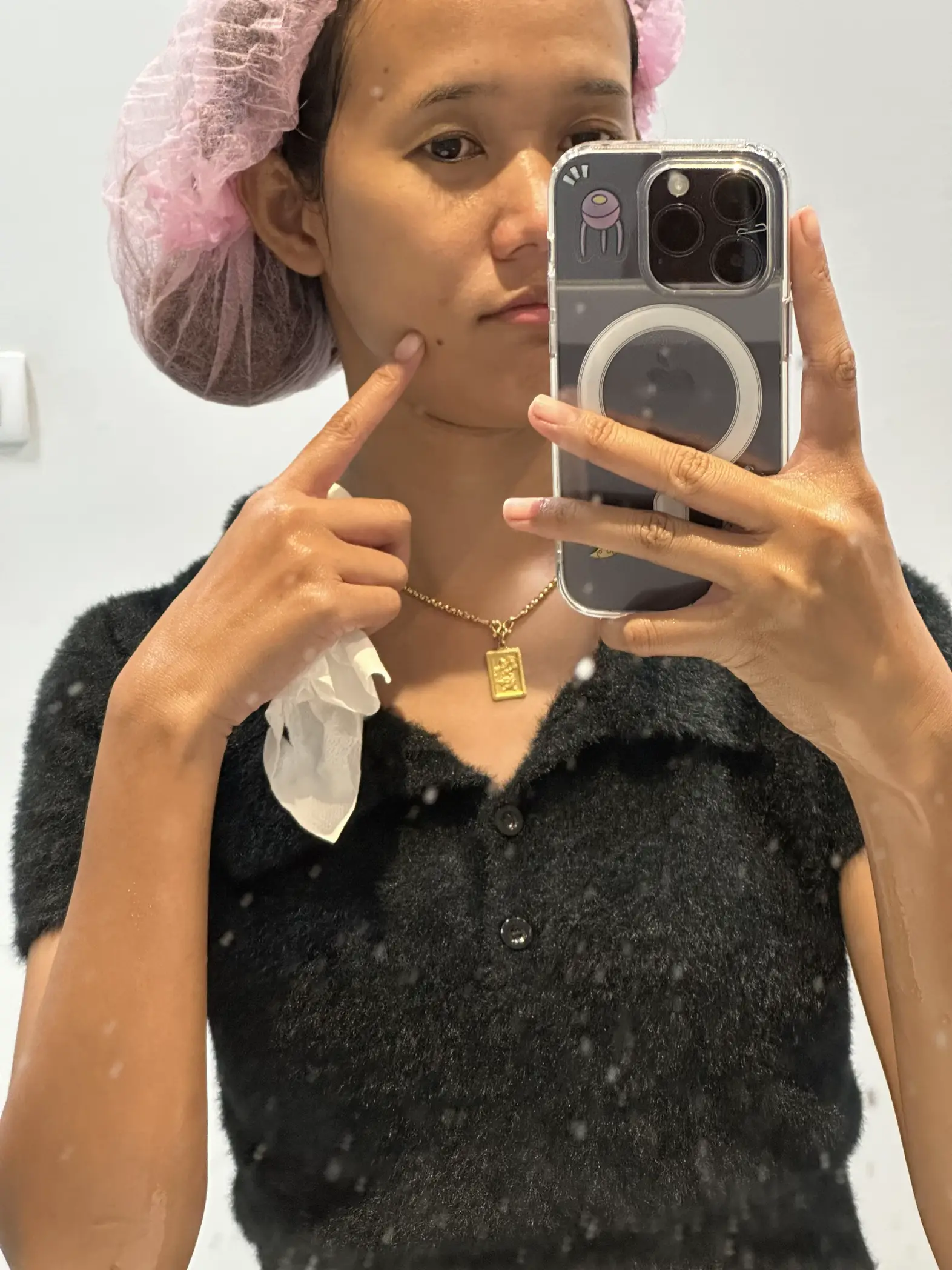 รีวิวผ่าไฝที่สถาบันโรคผิวหนัง อนุสาวรีย์ | แกลเลอรีที่โพสต์โดย Nooknik | Lemon8