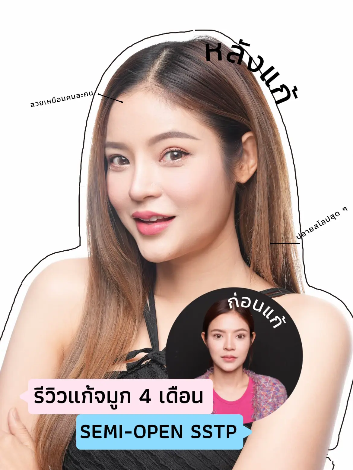 SEMI-OPEN SSTP 4-MONTH NUM REVIEW | Gallery posted by วินเซนต์พารีวิว ...