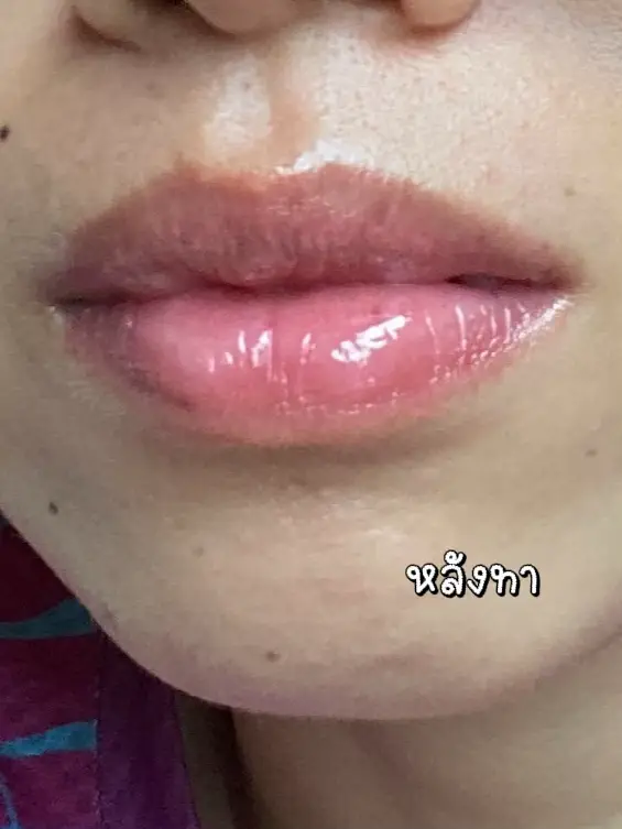 แก้ปากดำ ได้จริงดิ่ ? | แกลเลอรีที่โพสต์โดย Aunda | Lemon8