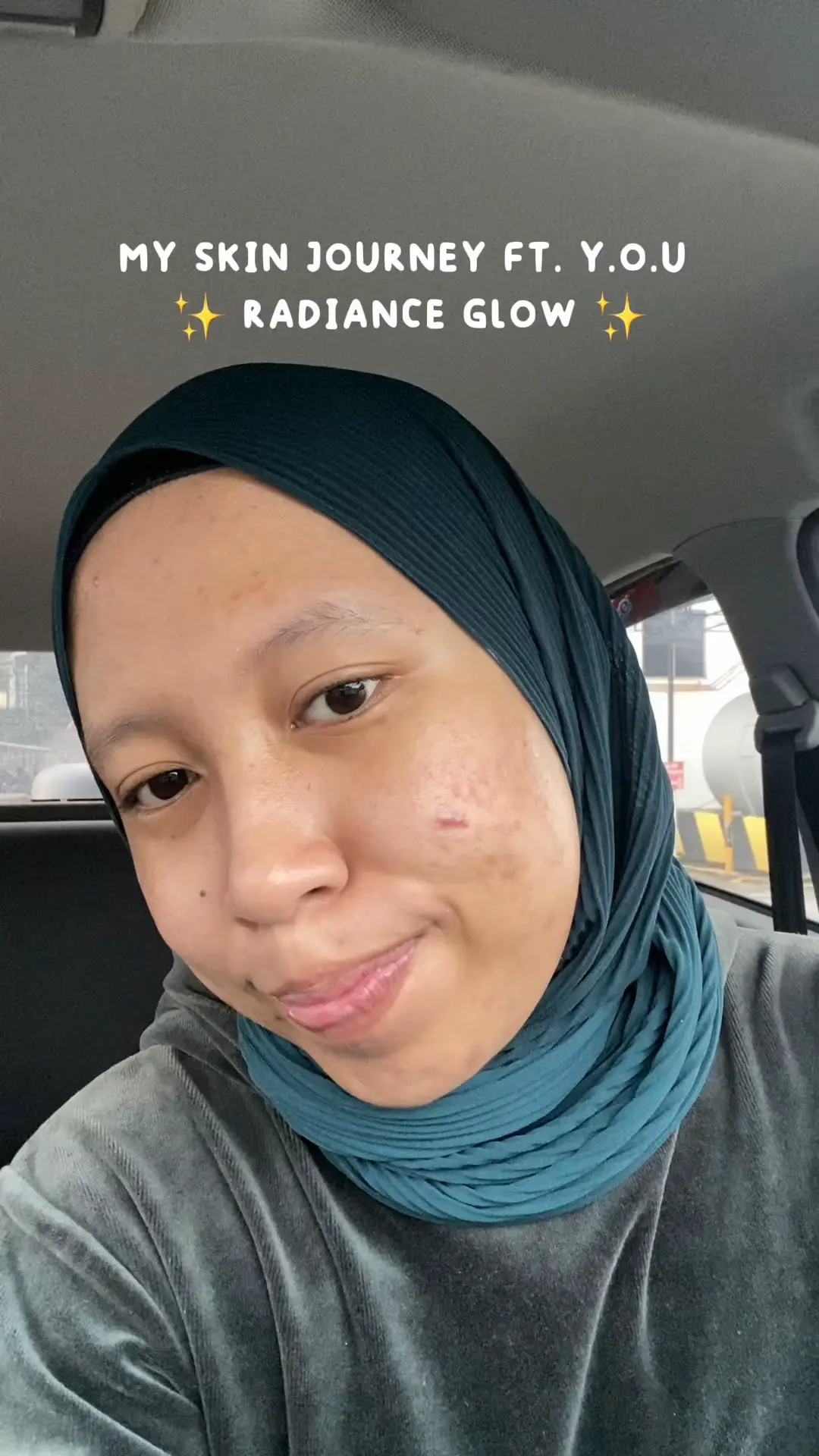Healthy & glowing skin must have | Video diterbitkan oleh nanad🐰 | Lemon8