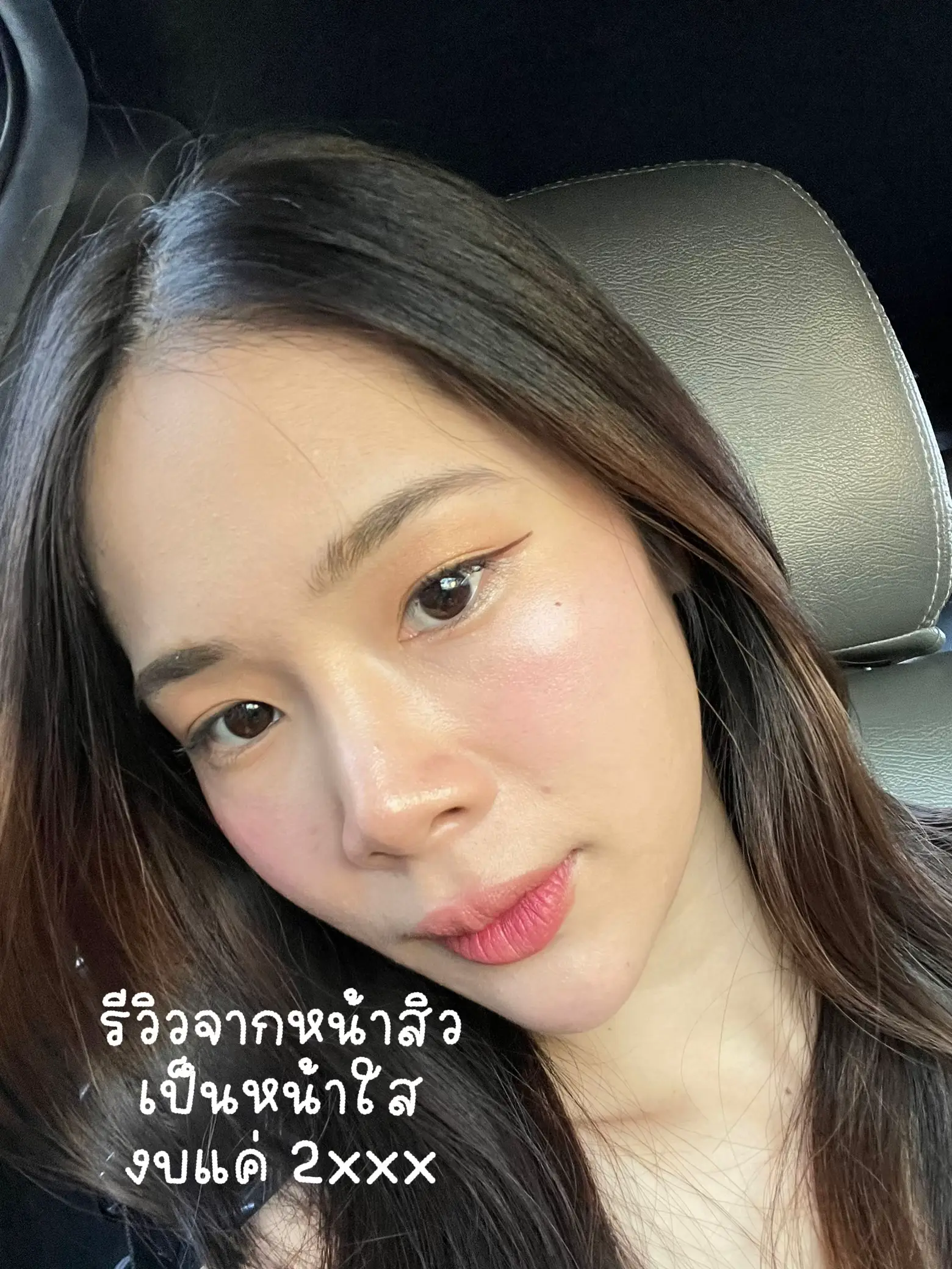 จากหน้าสิว เป็นหน้าใส งบแค่ 2xxx | แกลเลอรีที่โพสต์โดย Name.nv | Lemon8