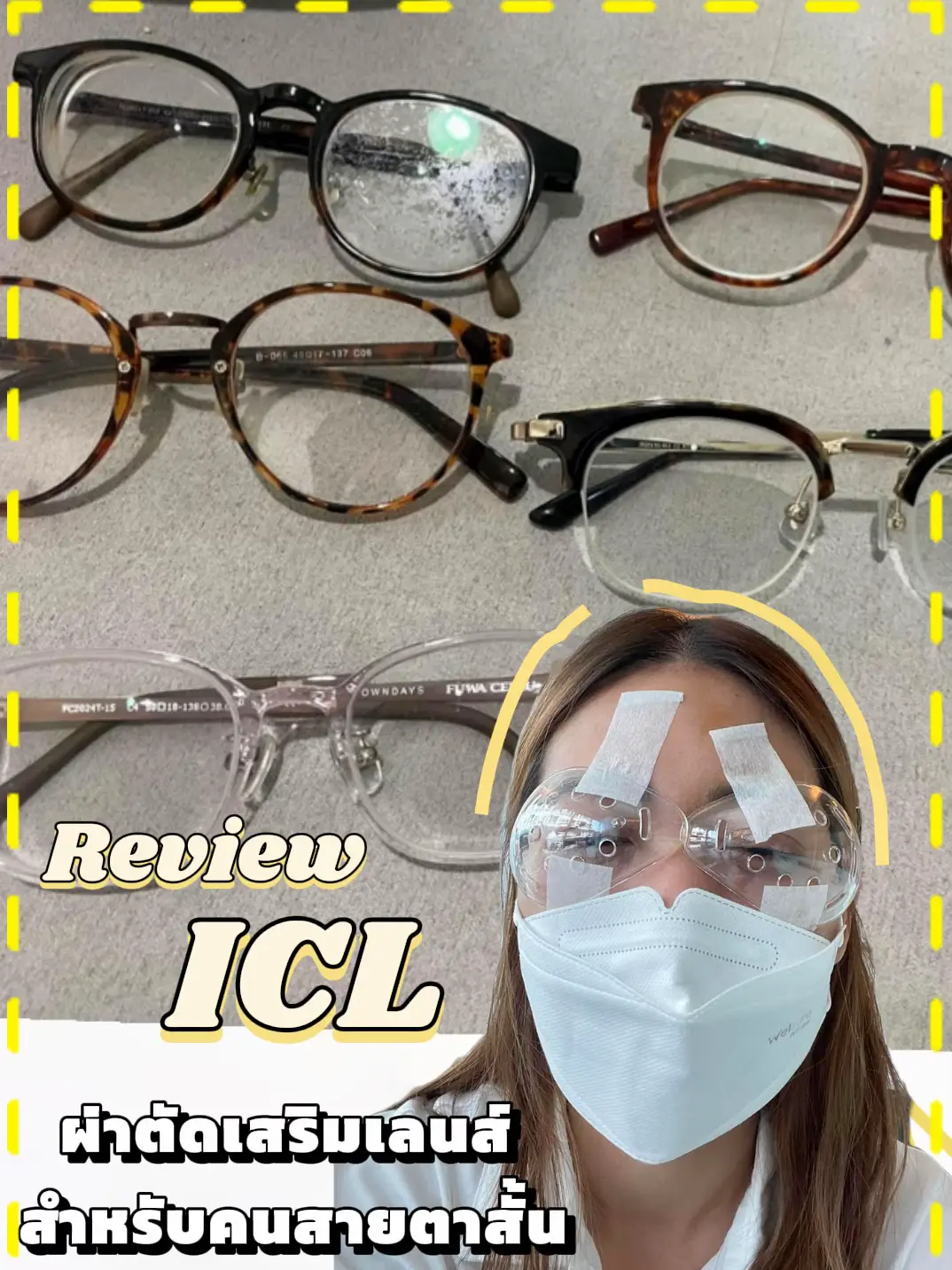 Review การผ่าตัดแก้ไขสายตาสั้น แบบใส่เลนส์เสริม ICL | แกลเลอรีที่โพสต์โดย NTM | Lemon8