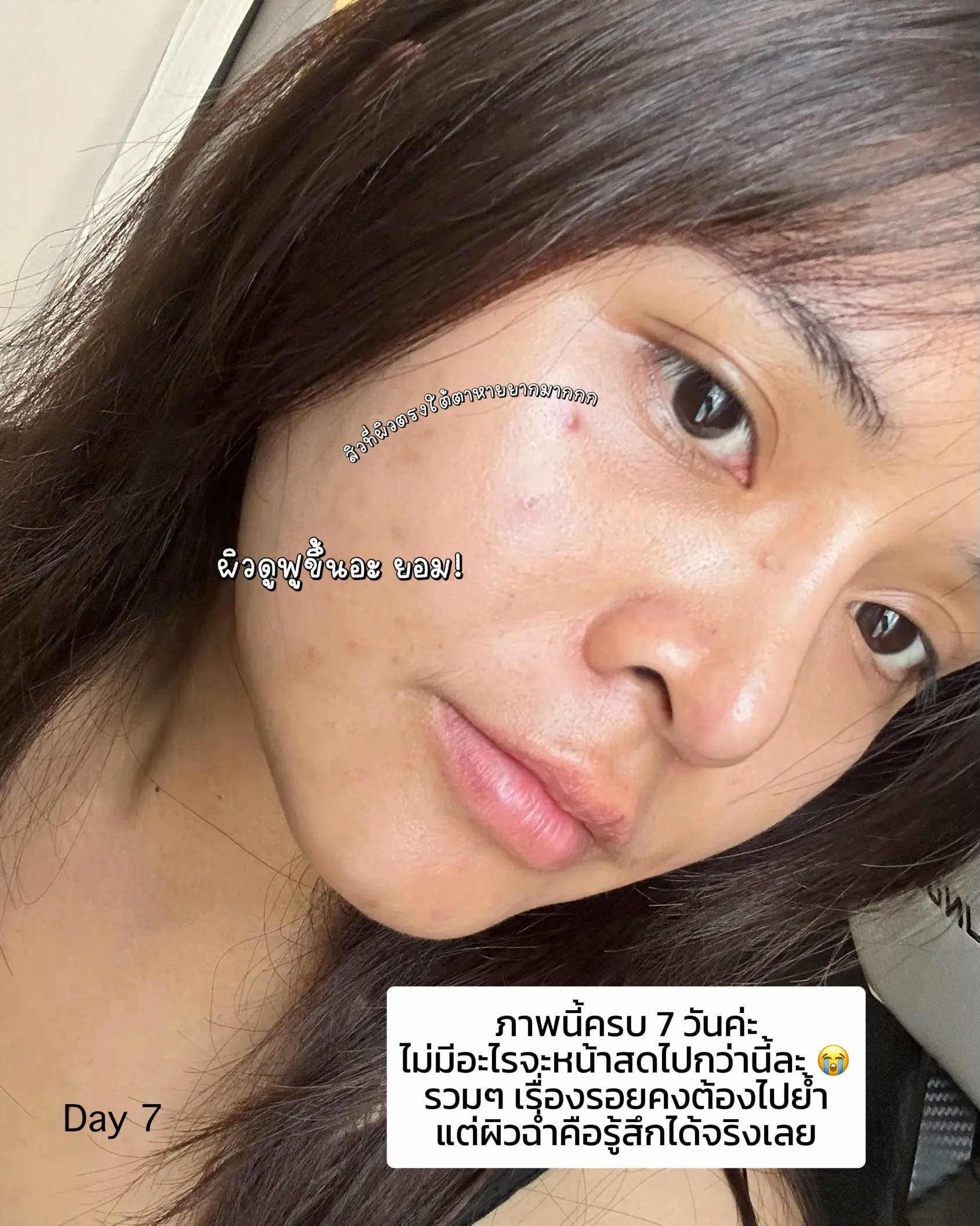 รีวิวจิ้ม Meso Celine | แกลเลอรีที่โพสต์โดย Muki.review | Lemon8