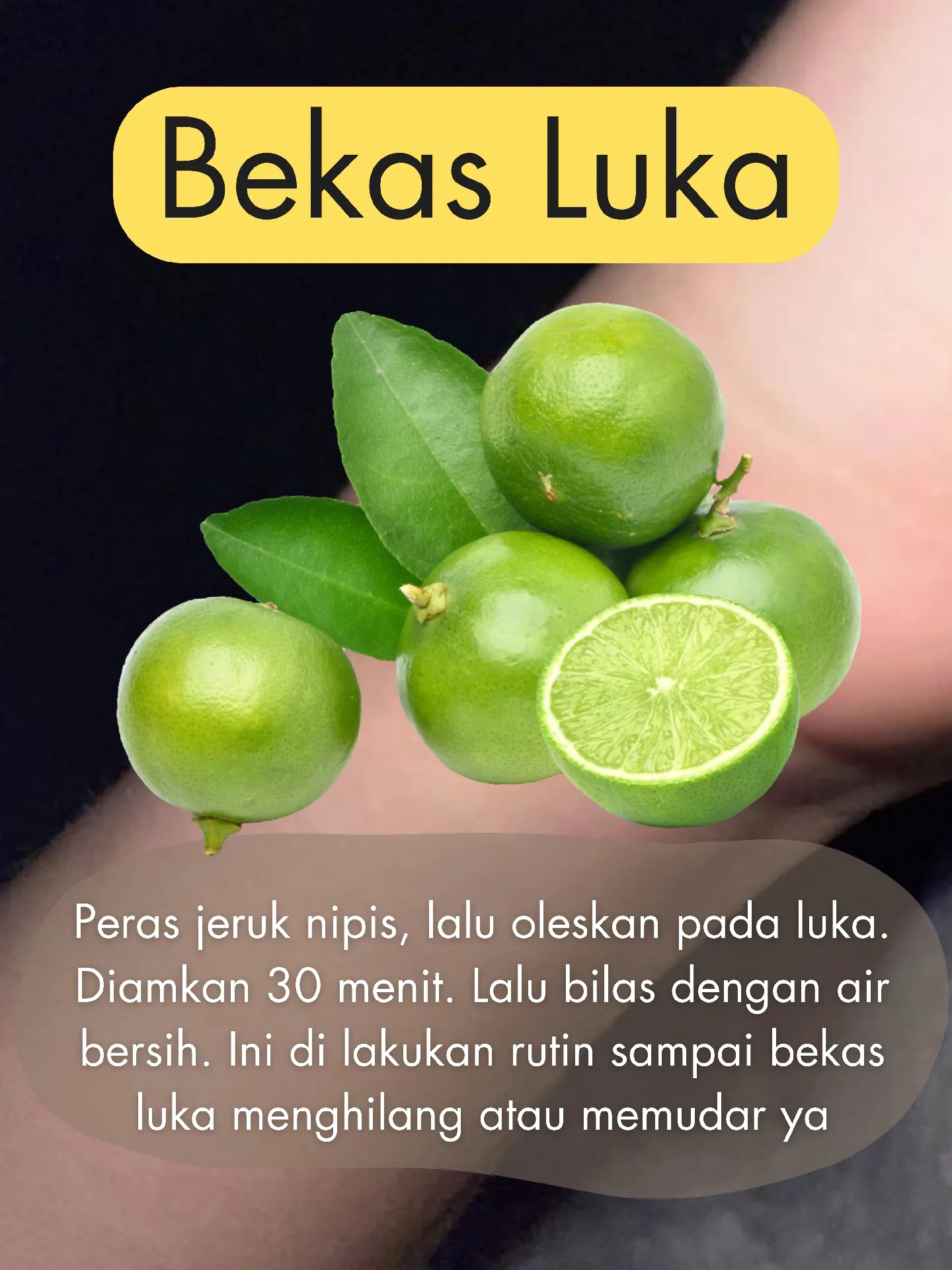 TIPS CEWEK RAWAT KETIAK, GIGI, LUKA, MATA PANDA | Galeri diposting oleh ...