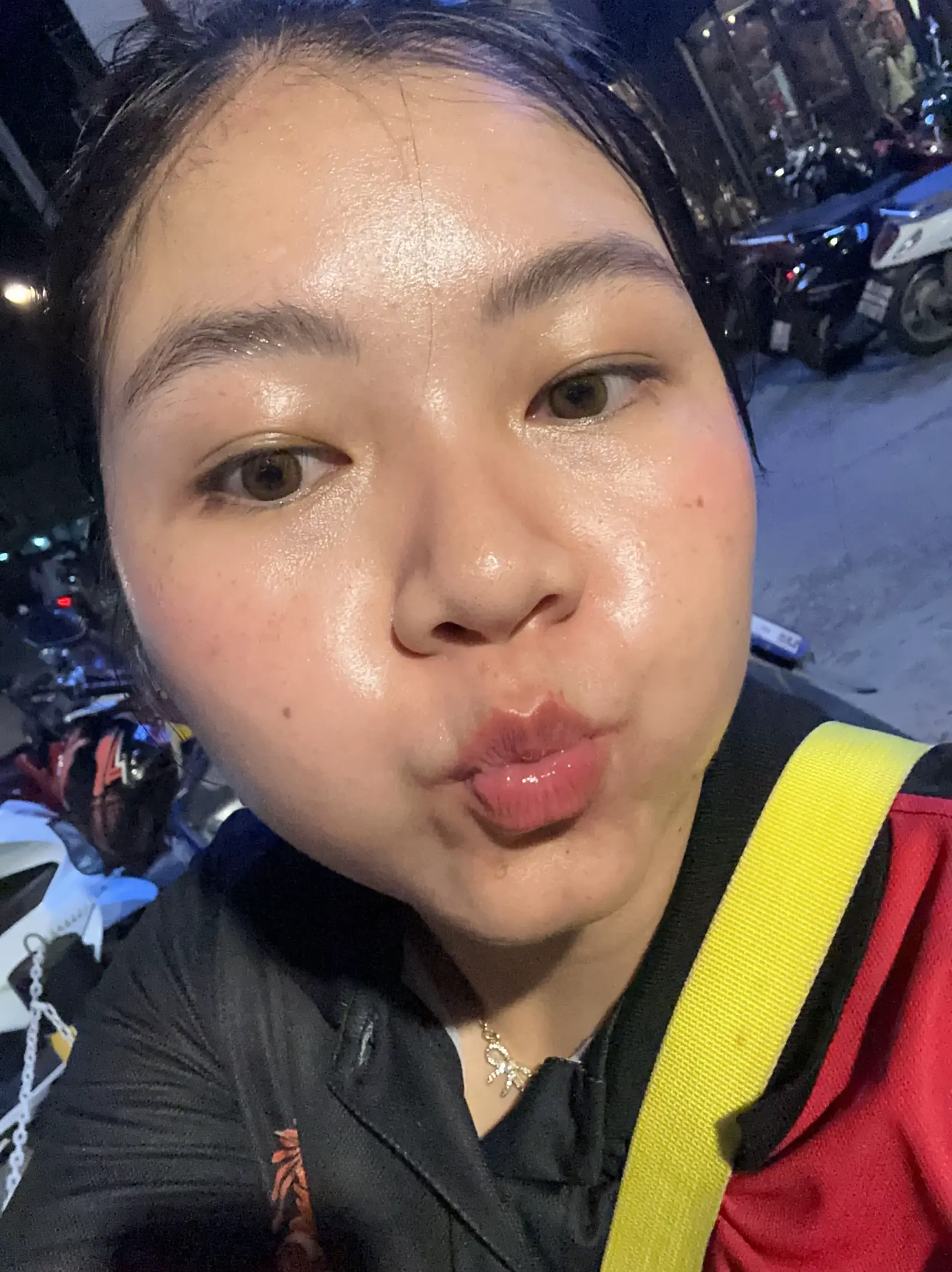 จากหน้าสิวสู่หน้าใส?! | แกลเลอรีที่โพสต์โดย Nps Waewnokyung | Lemon8