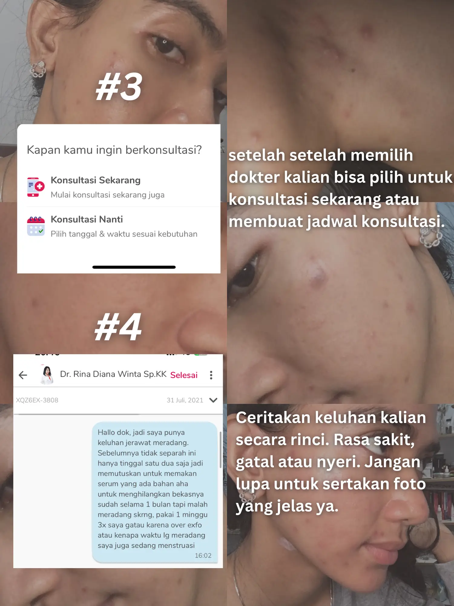 CARA KONSULTASI JERAWAT DI HALODOC! 🤩 | Galeri diposting oleh Nurulhalidah | Lemon8