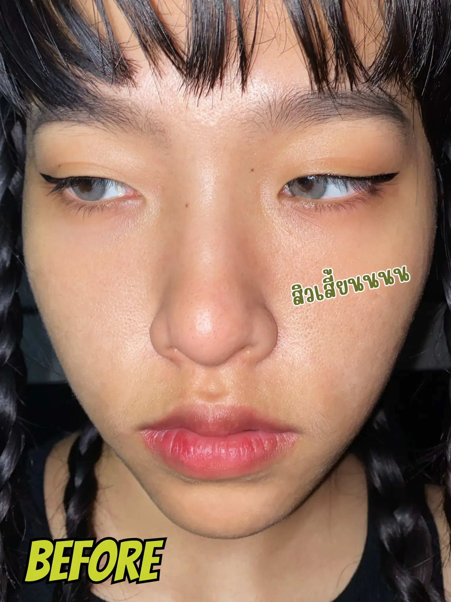 Review | แผ่นลอกสิวเสี้ยน สะใจ ของ The Original | แกลเลอรีที่โพสต์โดย ...