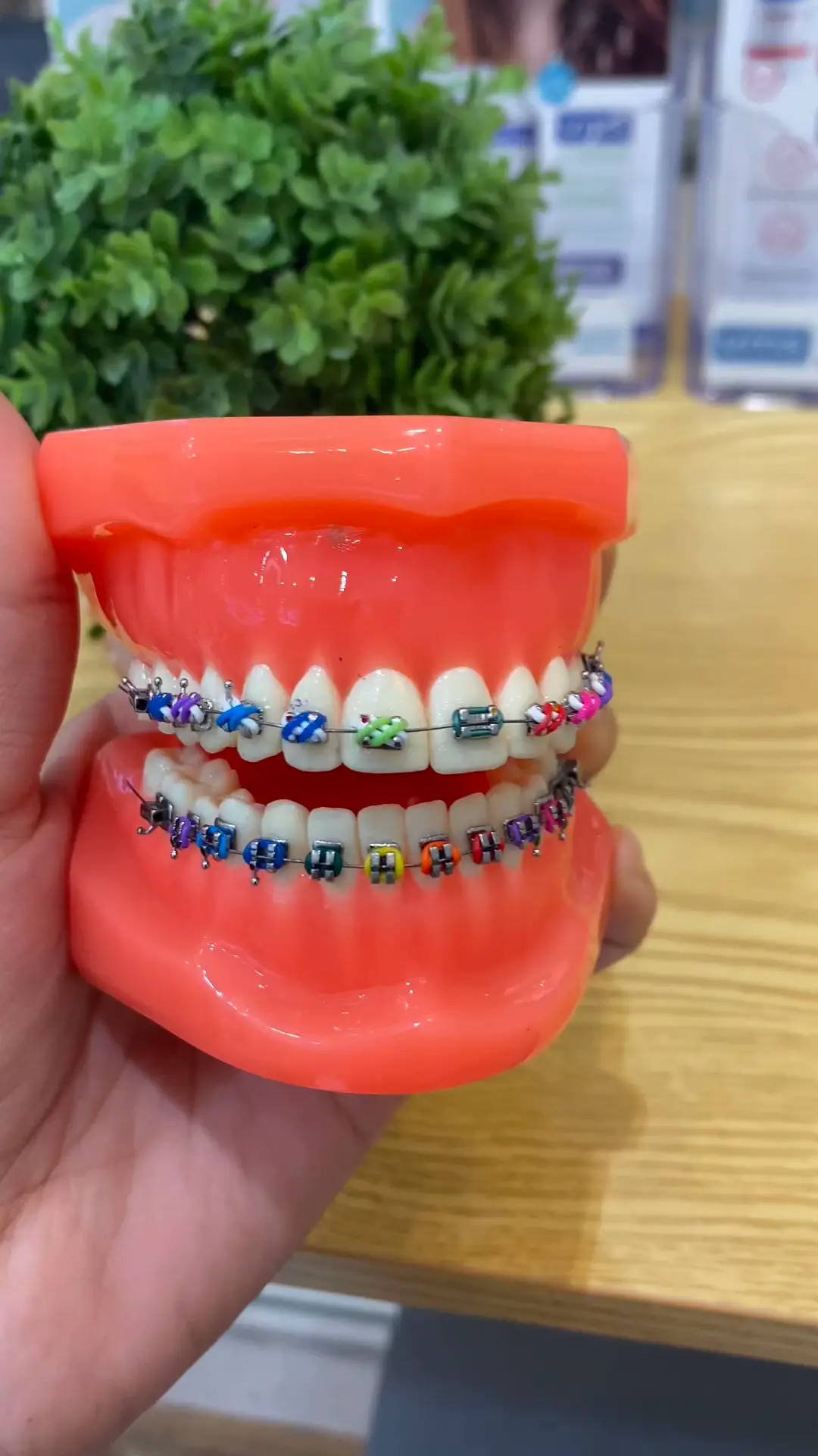 จัดฟันกับ Teeth Talk 999฿ 🌈🍭😍 | วิดีโอที่เผยแพร่โดย May SK. | Lemon8