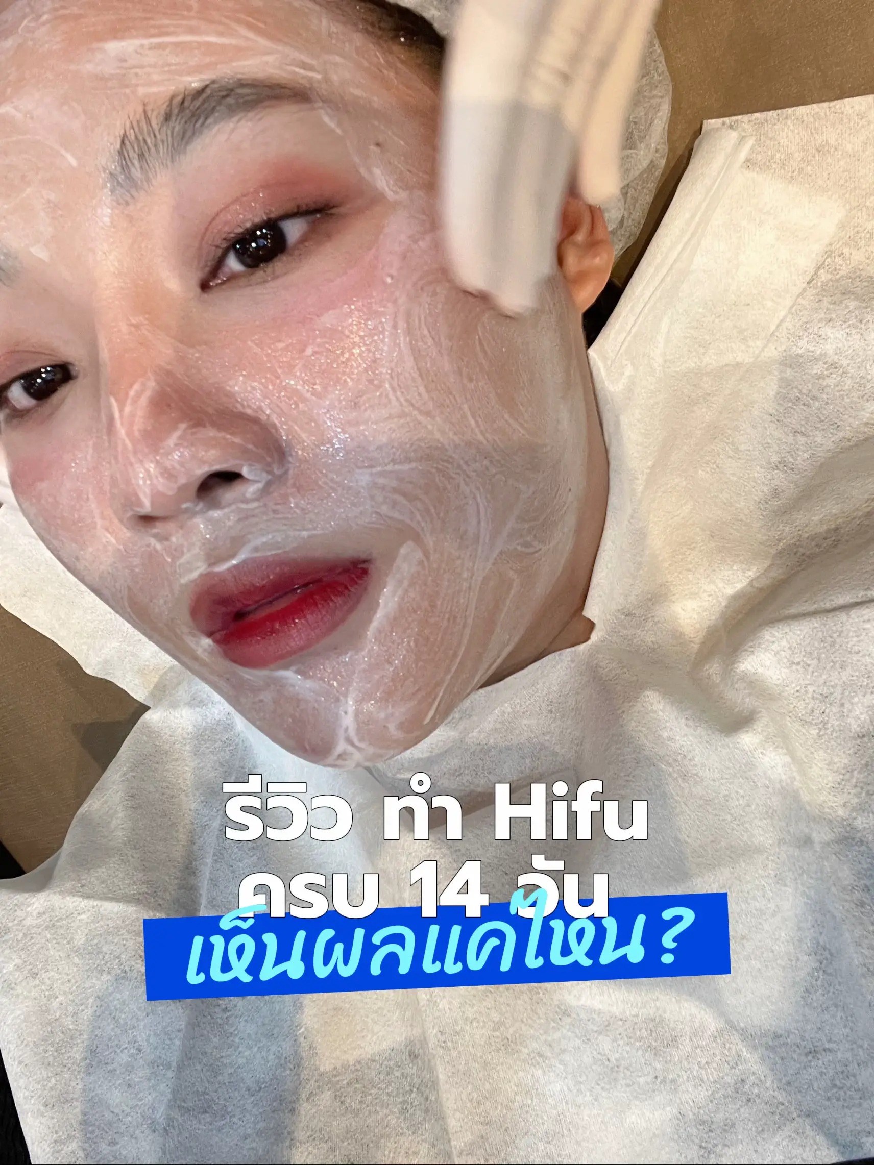 Premium Hifu สองแบ้งค์เทามีทอน เห็นผลจริง😱😱 | แกลเลอรีที่โพสต์โดย ตอเต่าป้ายยา💋👊🏻 | Lemon8