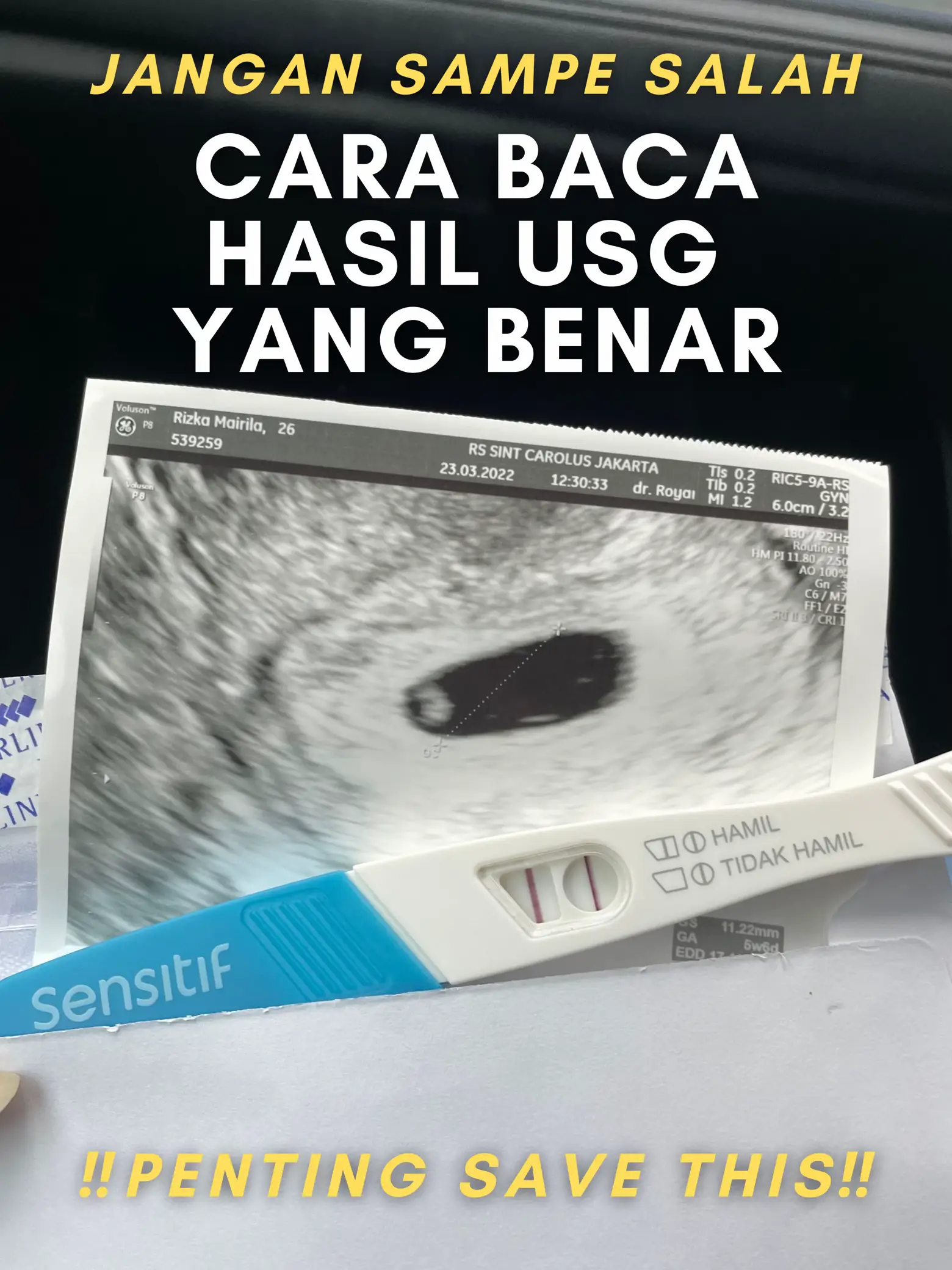 Jangan Salah, Begini Cara Baca Hasil USG Kehamilan | Galeri diposting oleh Ilaays | Lemon8