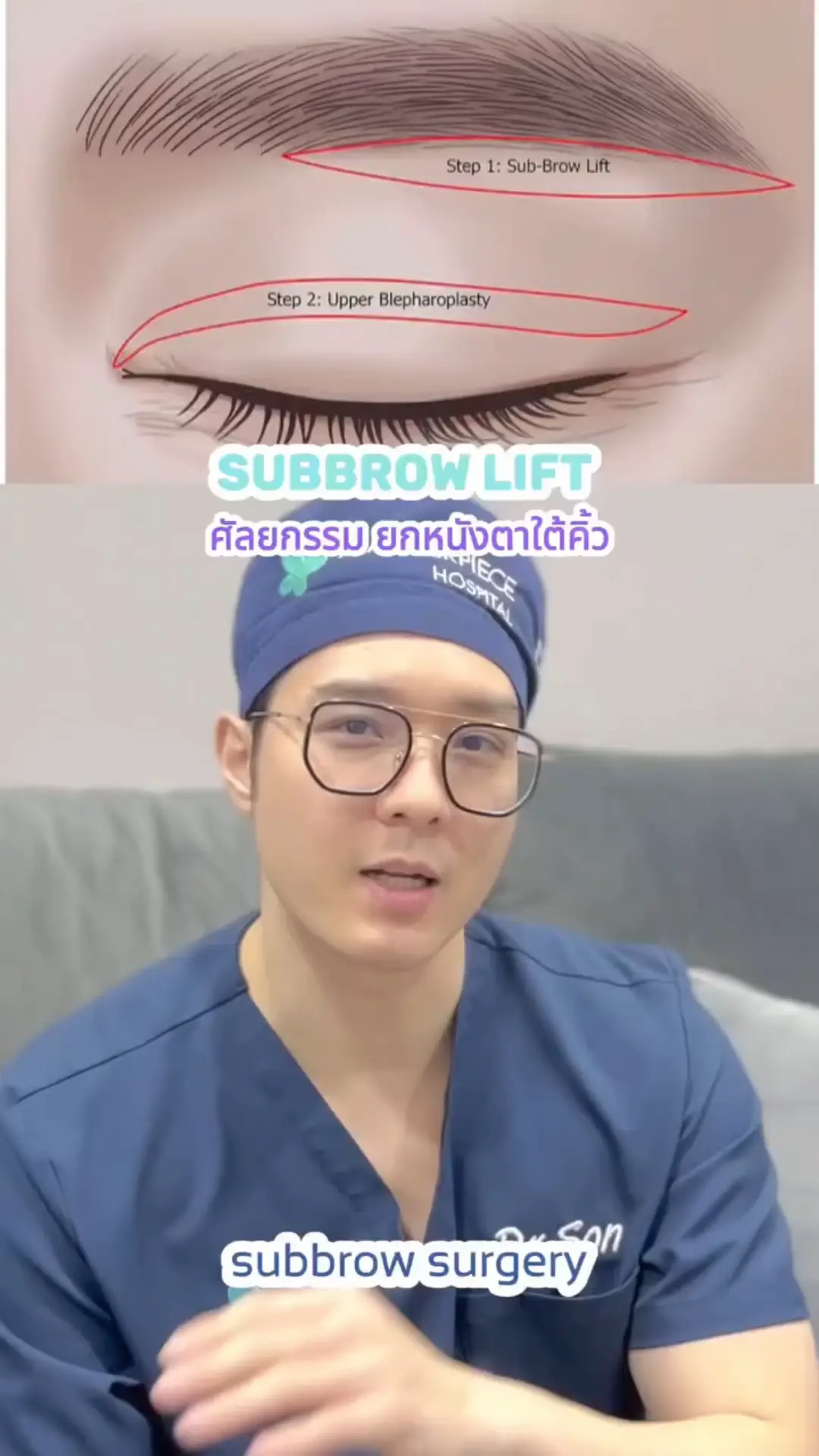 Sub-brow lift คืออะไร ? 🤔 | วิดีโอที่เผยแพร่โดย EyecenterByMTP | Lemon8