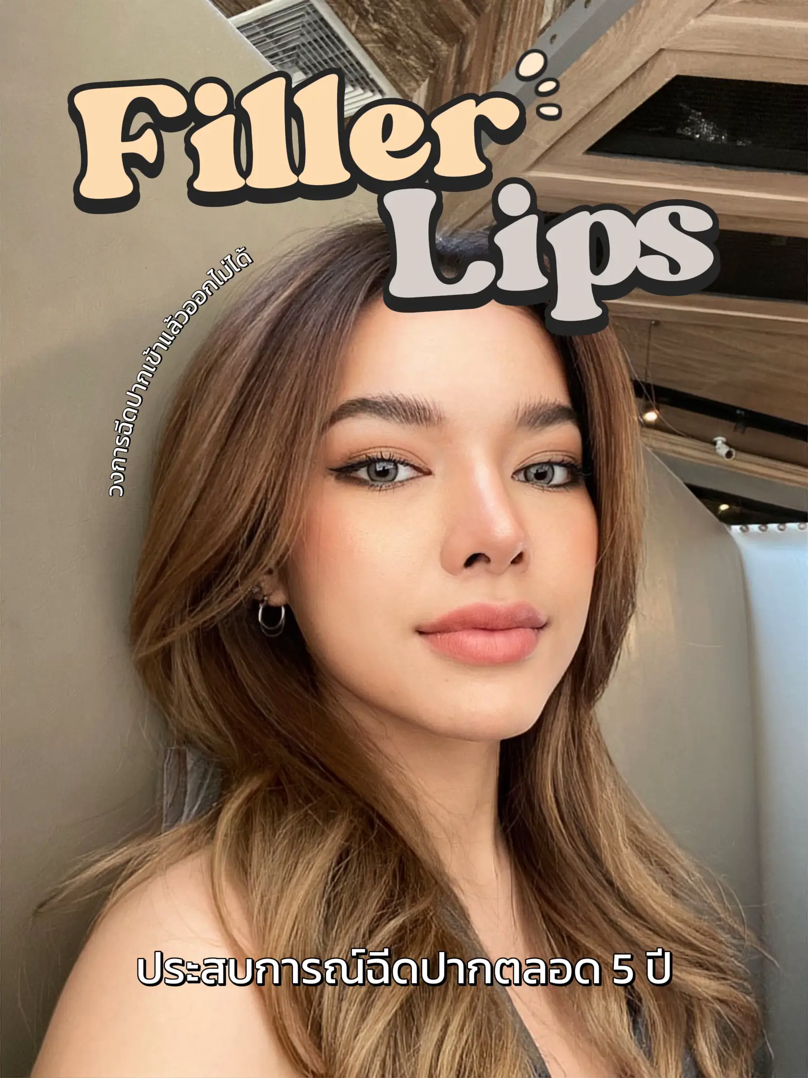 ประสบการณ์ฉีดปาก 5 ปี Filler 💋 | แกลเลอรีที่โพสต์โดย Ladyjame.s | Lemon8