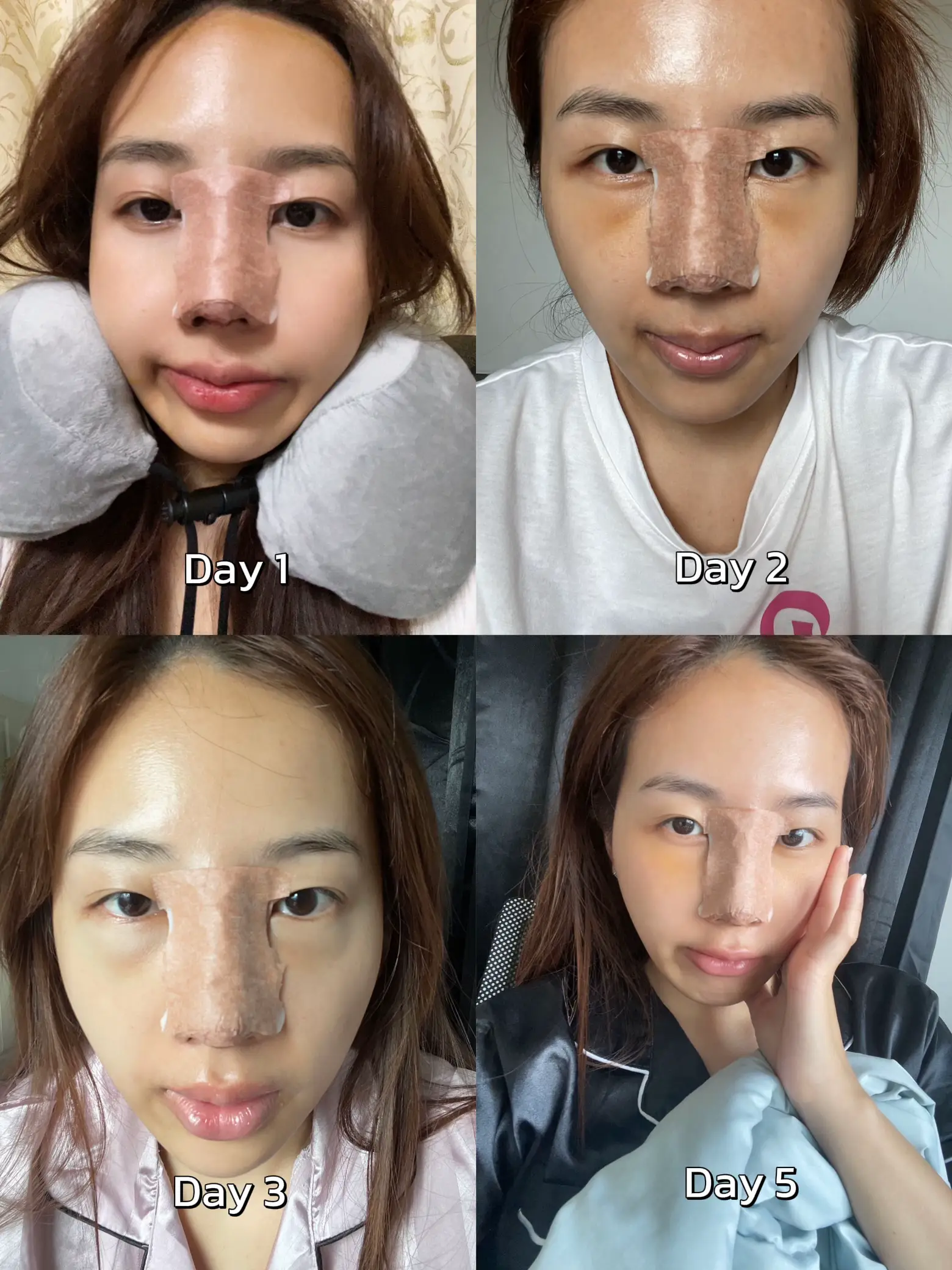 คลินิกหมอเมฆดีมั้ย - การค้นหาใน Lemon8