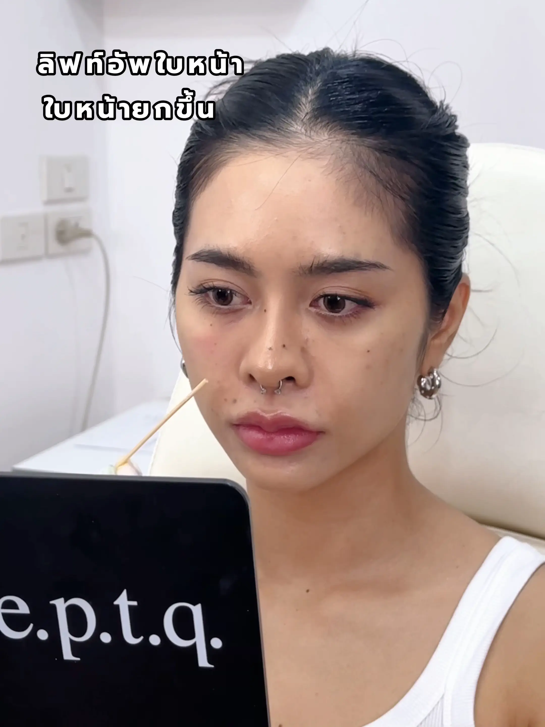 ฉีดใต้ตาแต่ได้ทั้งร่องแก้ม และยกกระชับใบหน้า แค่2cc | วิดีโอที่เผยแพร่โดย Malika Clinic | Lemon8