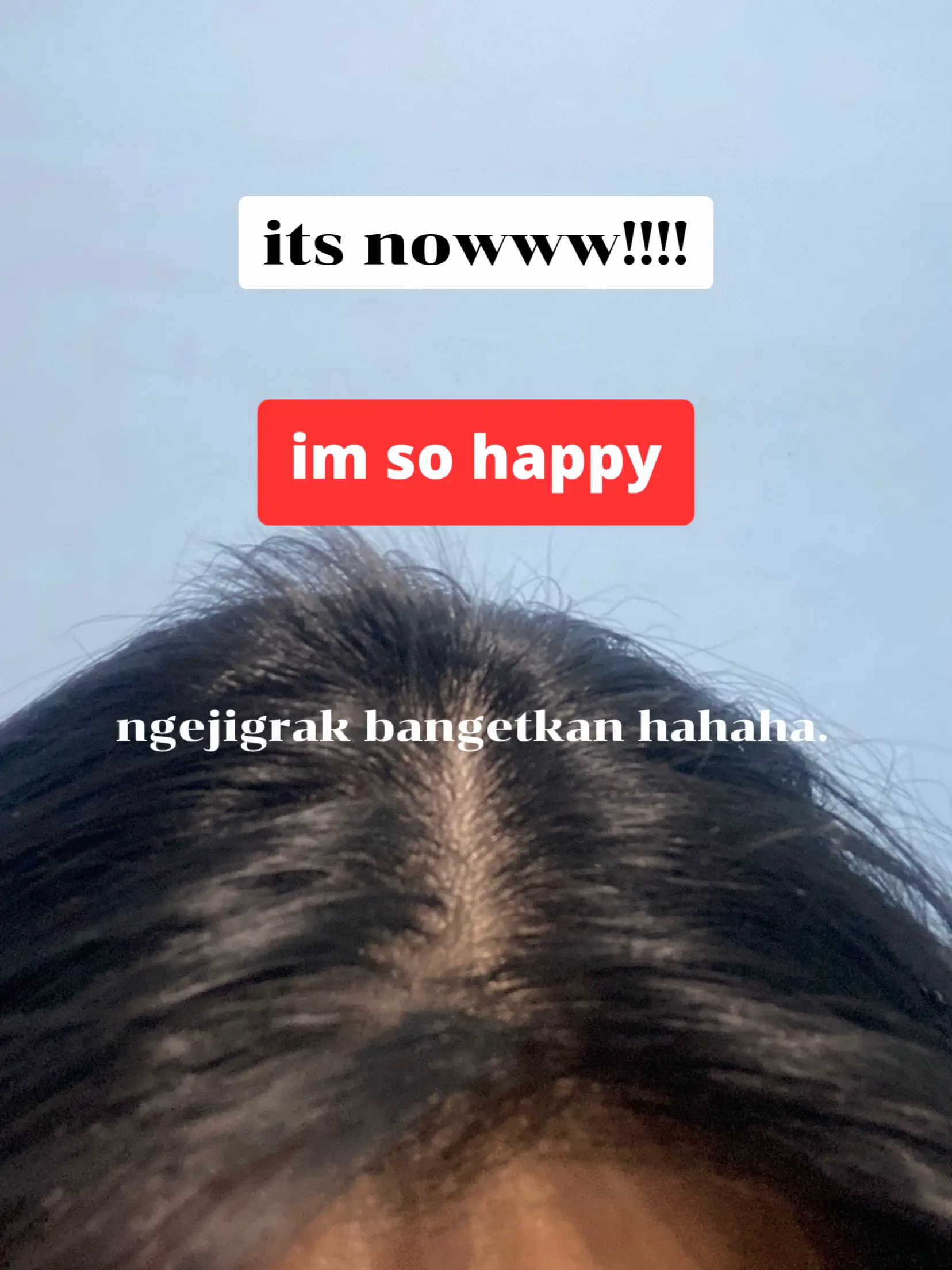 RAMBUT MEMBOTAK KARENA RONTOK? INI SOLUSINYA! | Galeri diposting oleh fey | Lemon8