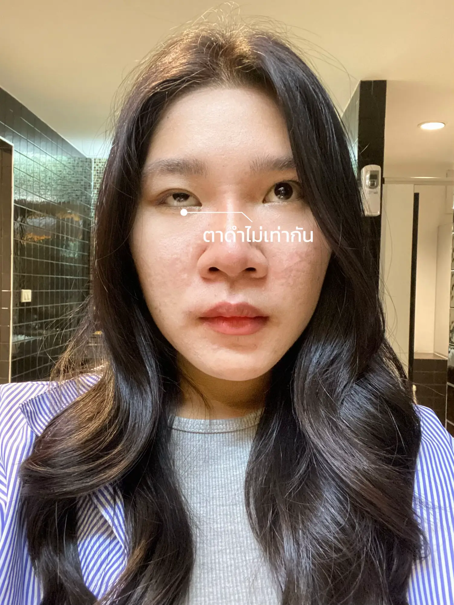 Update Ultraformer (28/05/2024) | user_published_gallery | Lemon8