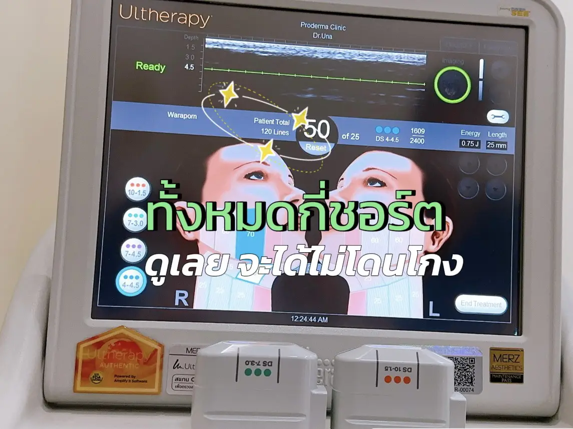 หน้าจอ Ulthera บอกอะไรเราบ้าง | แกลเลอรีที่โพสต์โดย ProDerMa | Lemon8
