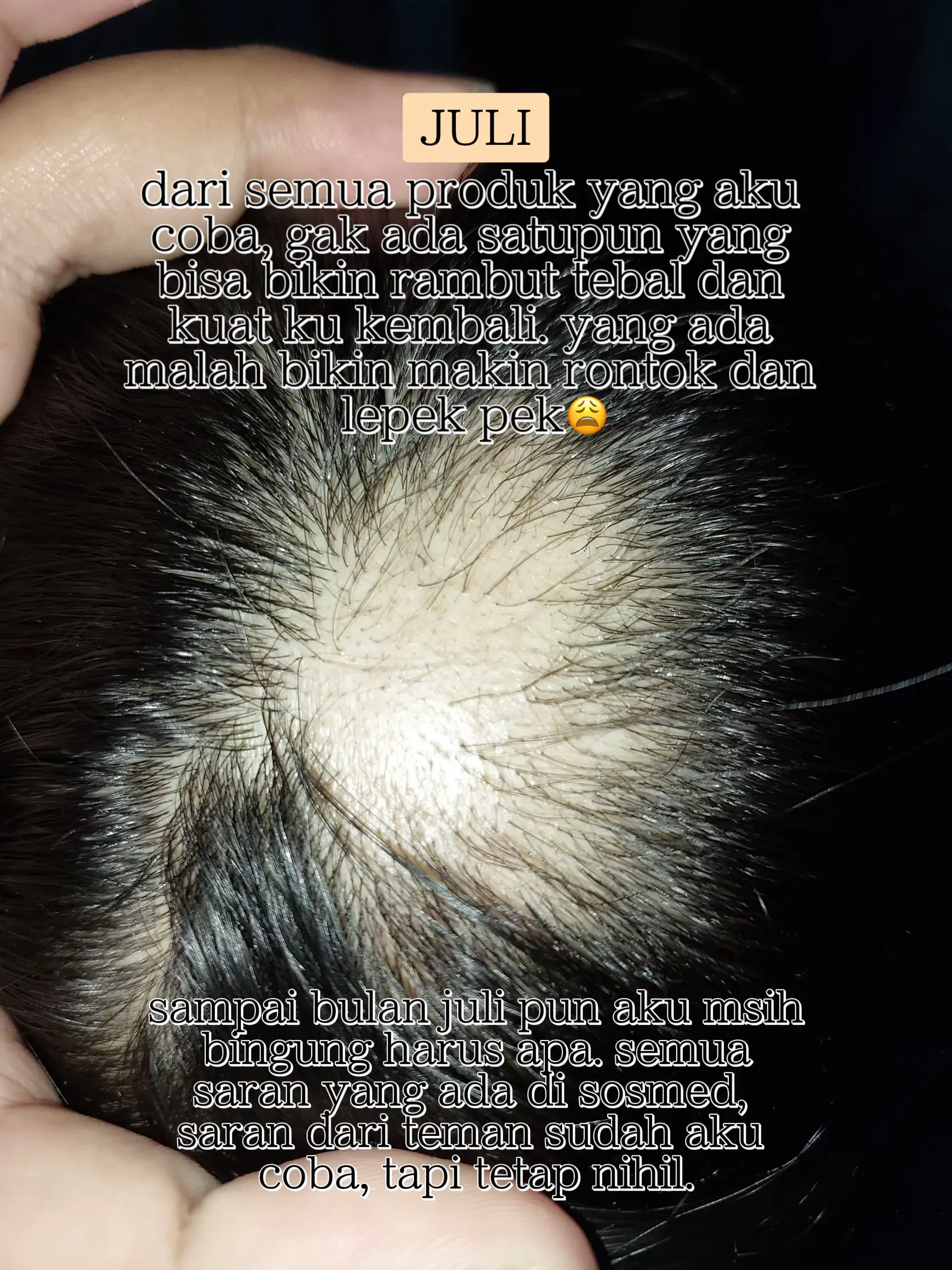 RAMBUT MEMBOTAK KARENA RONTOK? INI SOLUSINYA! | Galeri diposting oleh fey | Lemon8