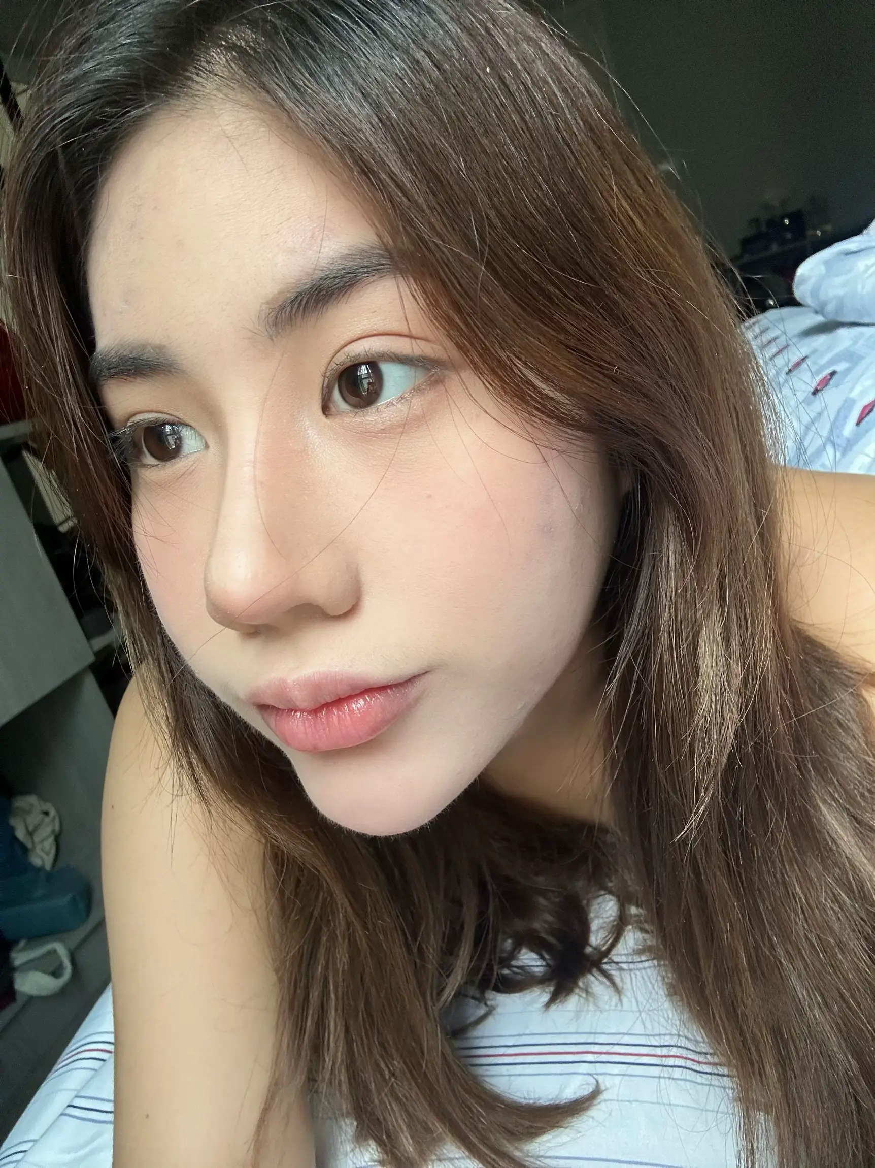 มหากาพย์รักษารอยสิวด้วยตัวเอง! | แกลเลอรีที่โพสต์โดย cherlin.er | Lemon8