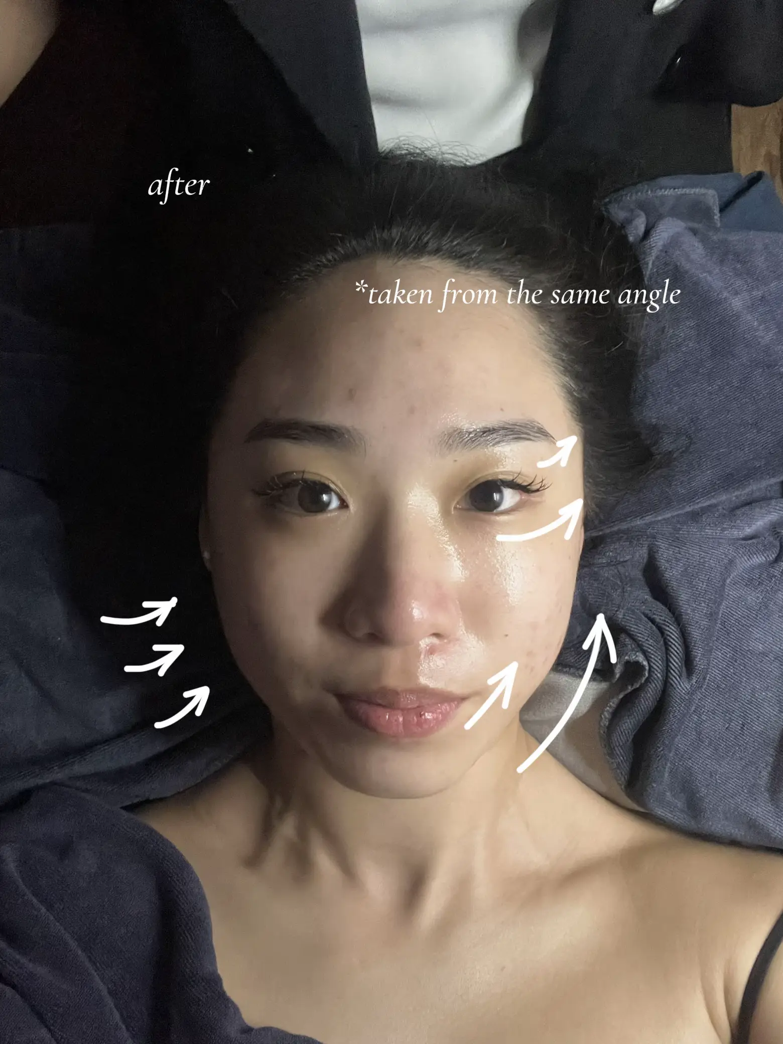 I used to not believe in Bojin Facials until... 😮 | Gallery posted by ...