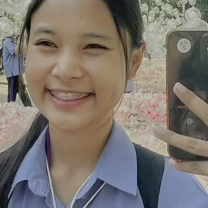 จัดฟัน 3 เดือนหมดไป 33,xxx บาท🥹 (ep.2) | แกลเลอรีที่โพสต์โดย Newcleaar 💖 | Lemon8