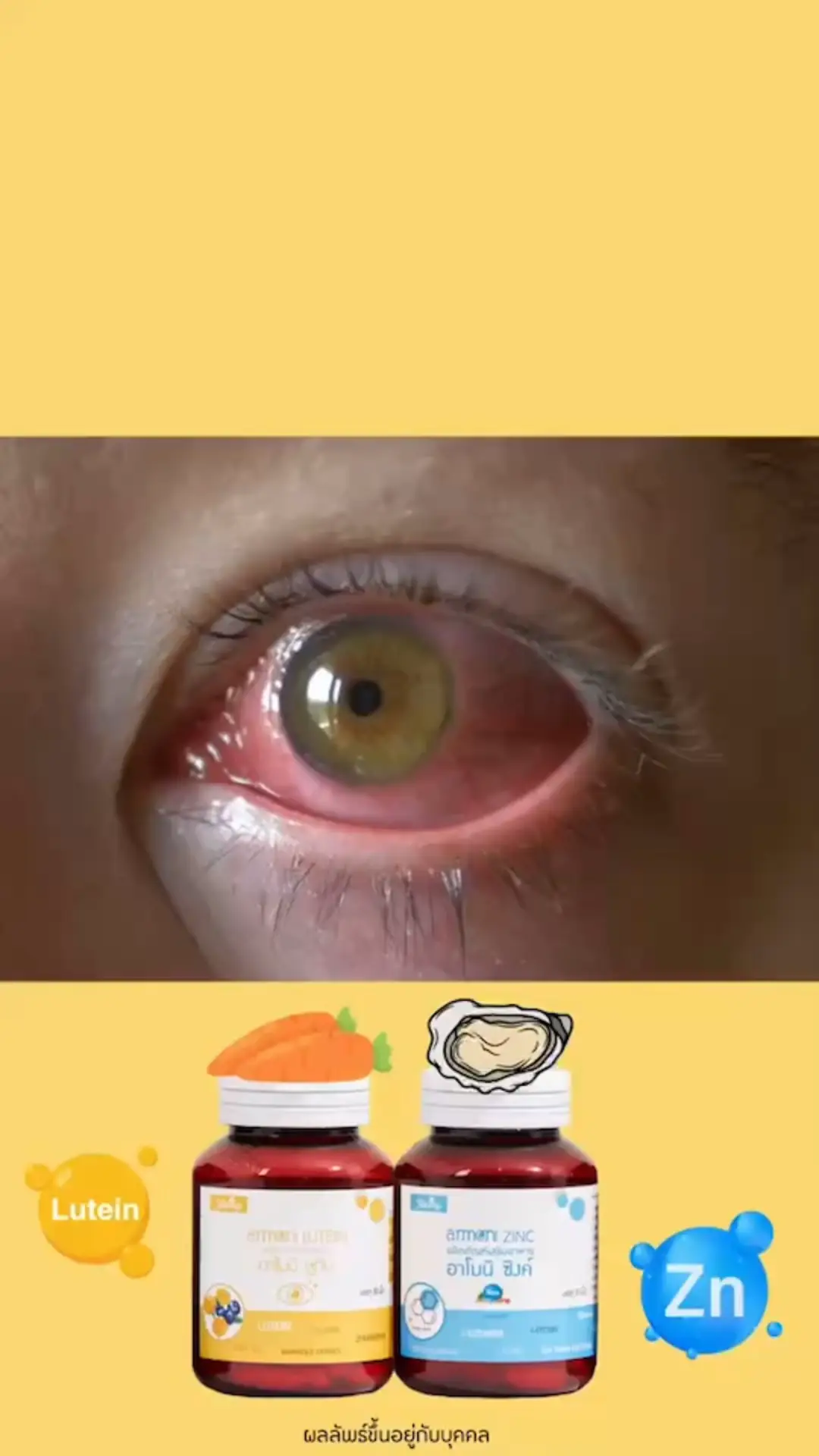 วิตามิบำรุงดวงตา | วิดีโอที่เผยแพร่โดย 【𝓕𝓸 𝓯𝓪𝓲𝓲】 | Lemon8