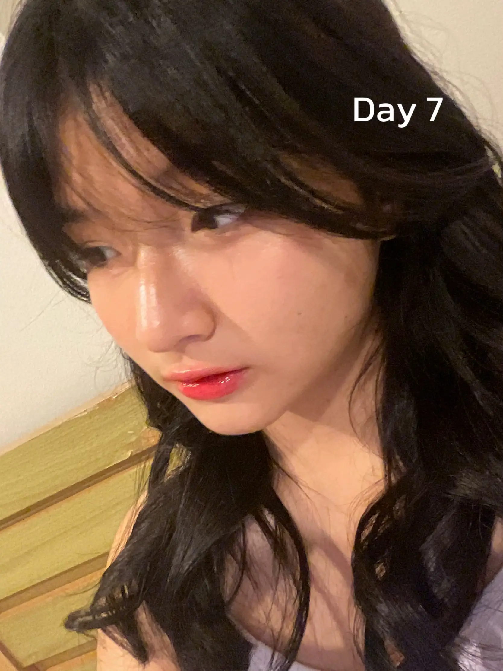 รีวิว Pico laser แบบพลีชีพ!! | แกลเลอรีที่โพสต์โดย nws_pancake | Lemon8