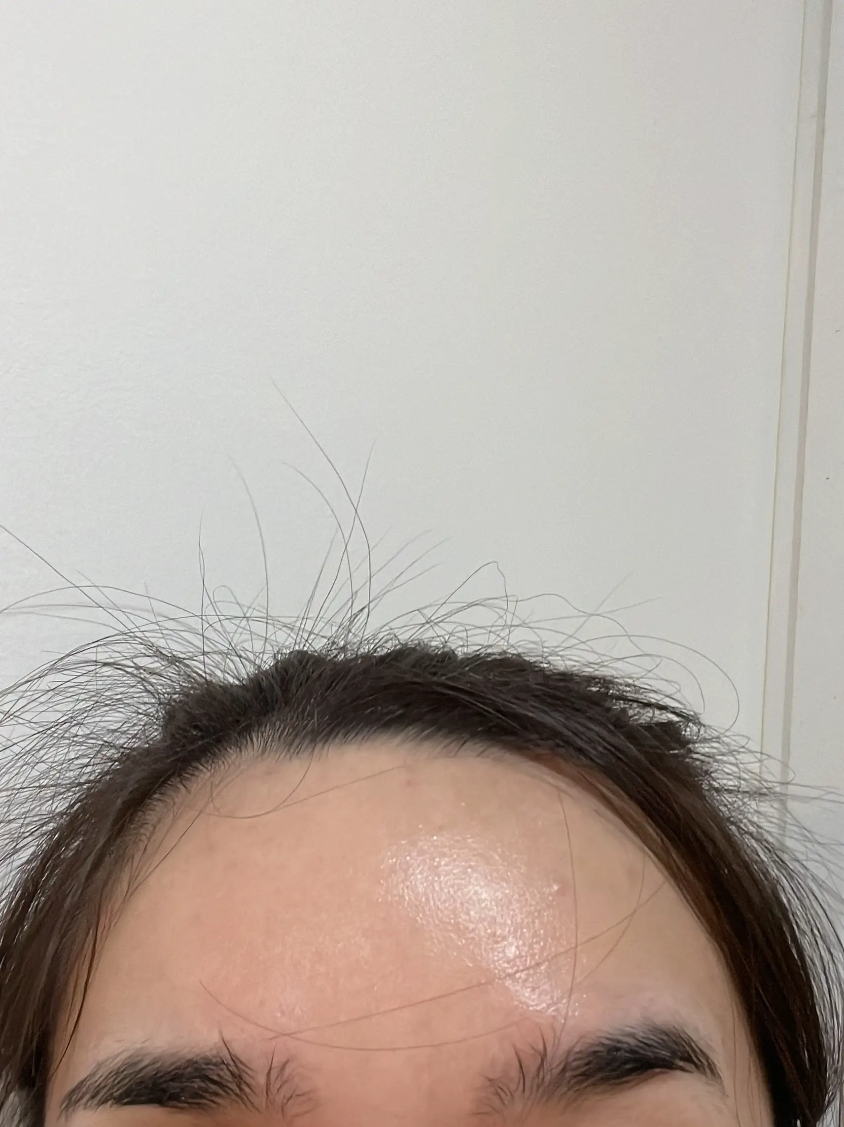 กู้หน้าสิวฉบับเร่งด่วน | แกลเลอรีที่โพสต์โดย Phatcharawan Ja | Lemon8