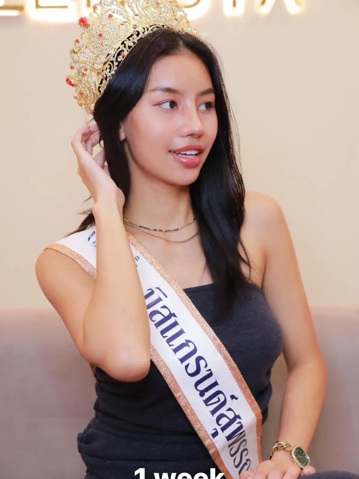 รีวิวแก้จมูก เลอนิสต้า คลินิก 💗 | แกลเลอรีที่โพสต์โดย Kanokwan N. | Lemon8