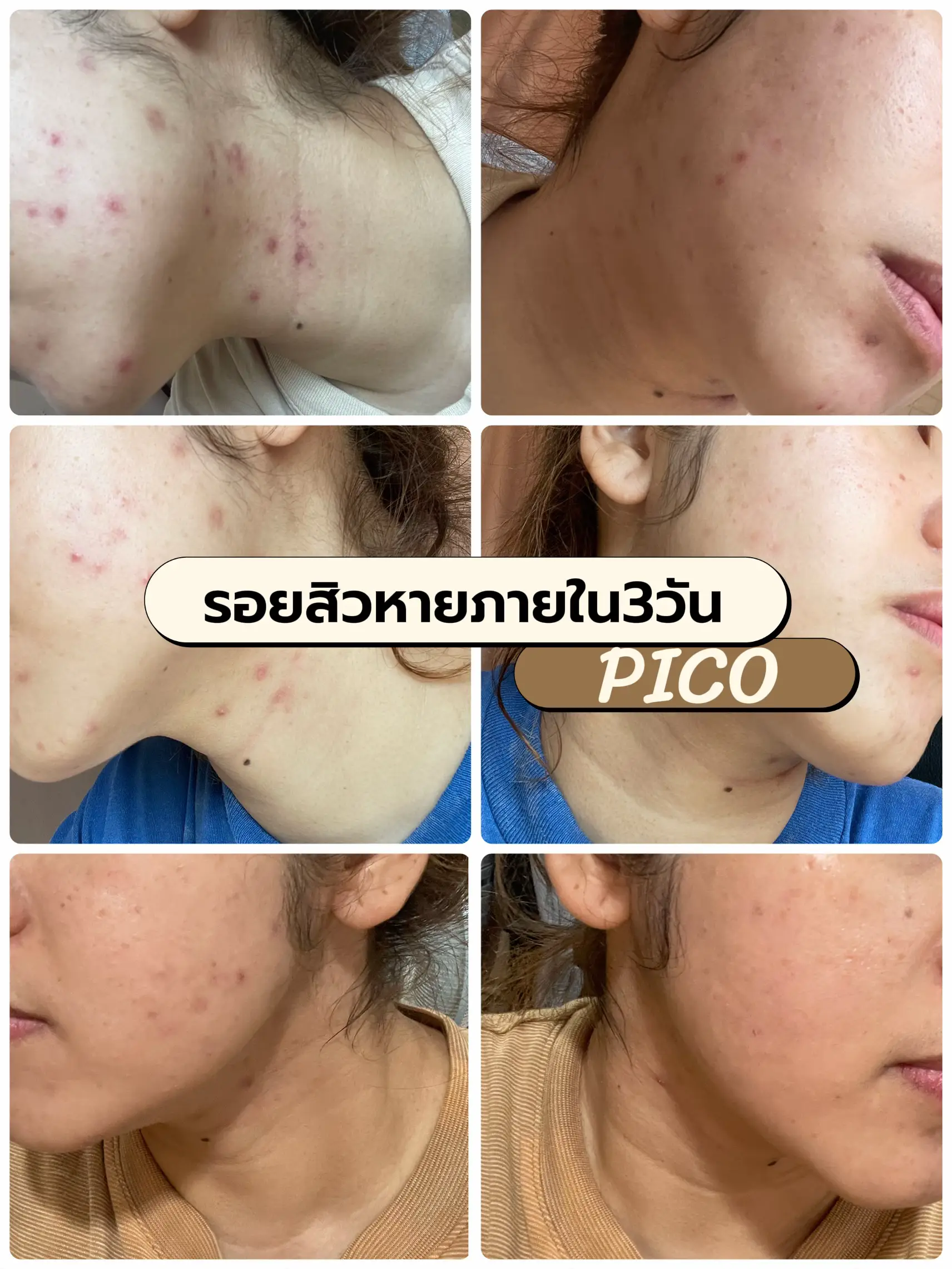 PICO Discovery | แกลเลอรีที่โพสต์โดย Faiifii | Lemon8