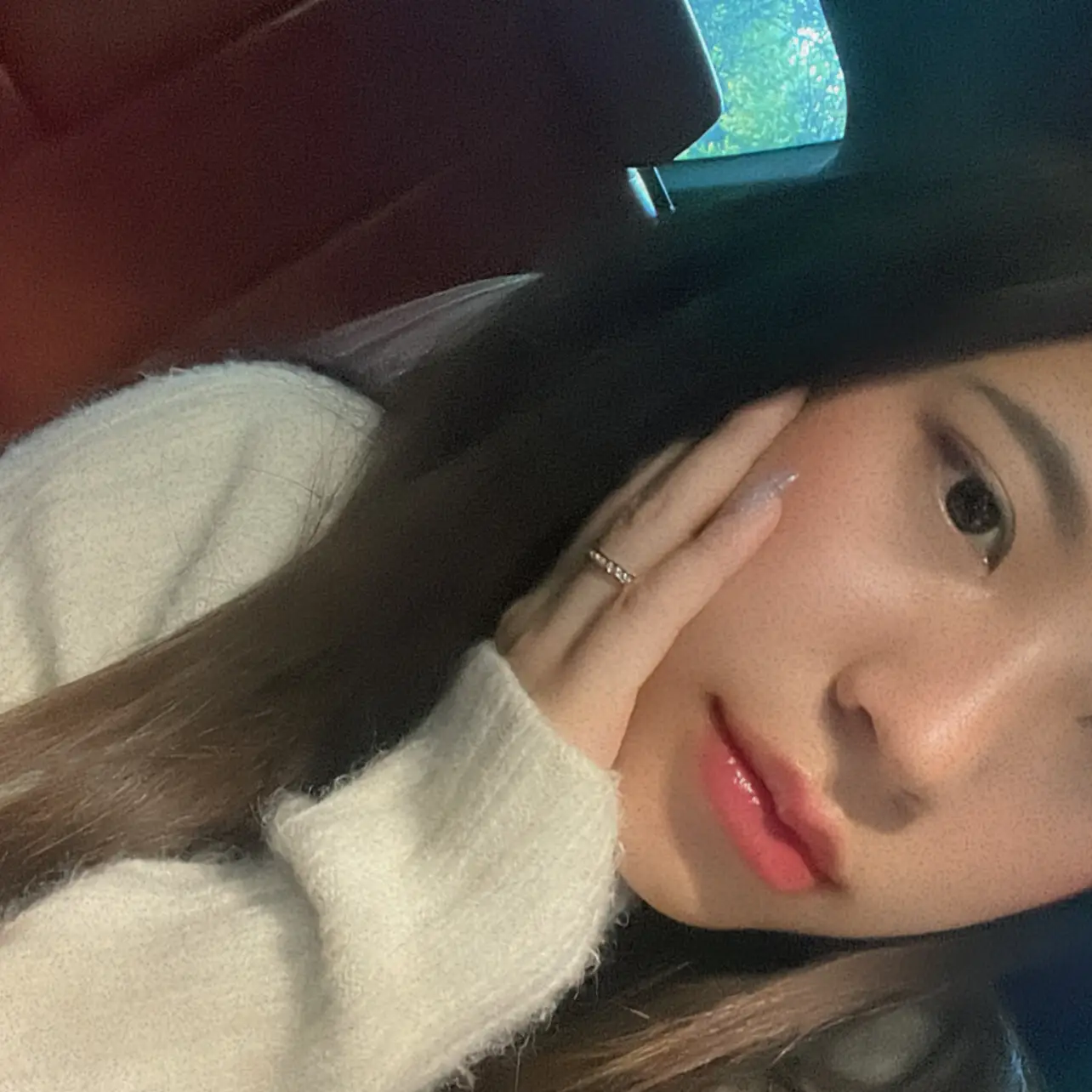 Neuramis deep - ฉีดปากครั้งแรก | แกลเลอรีที่โพสต์โดย Imma Ming | Lemon8