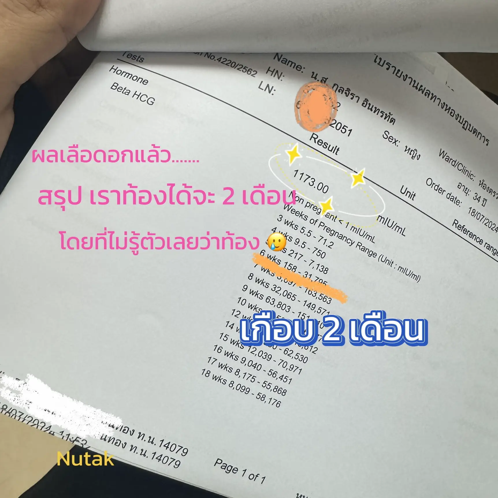 ประสบการณ์ที่ไม่อยากให้เกิด 😥 | แกลเลอรีที่โพสต์โดย NuTaK :D 😊 | Lemon8