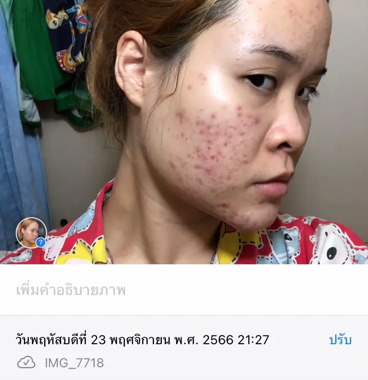 การรีวิวที่พลีชีพที่สุดดด | แกลเลอรีที่โพสต์โดย style.ness | Lemon8