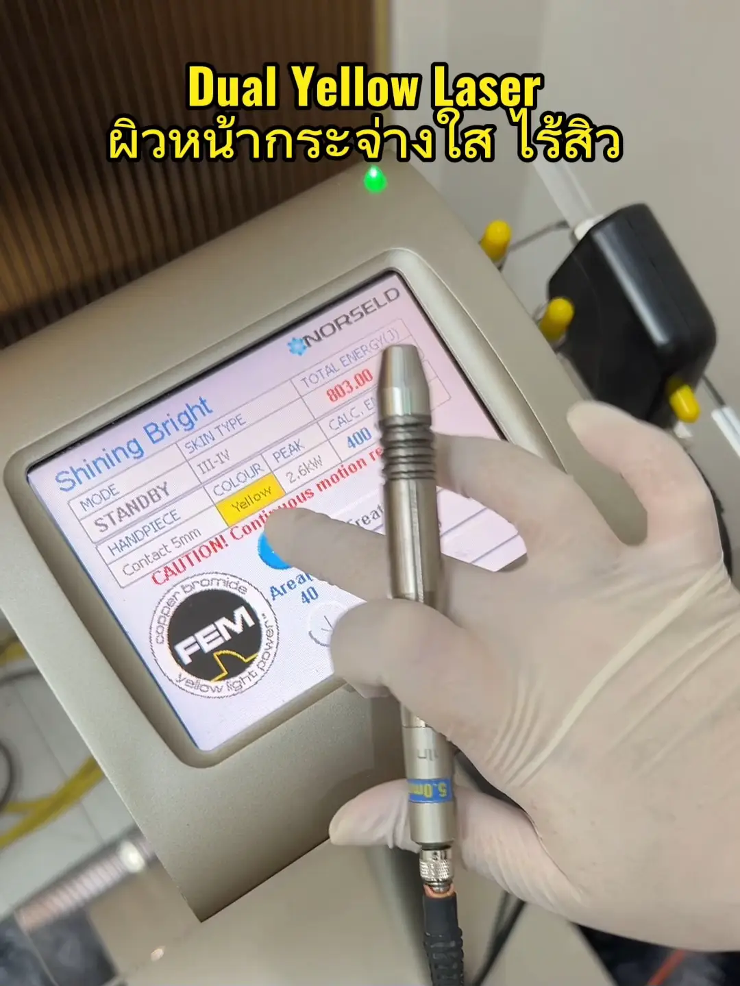เลเซอร์หน้าใสยอดฮิตสุดในปี 2024 Dual Yellow Laser | วิดีโอที่เผยแพร่โดย ...