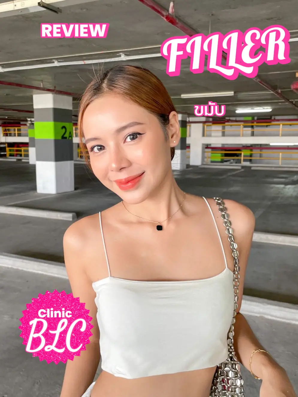 รีวิวฉีด FILLER ขมับครั้งแรกกก ‼️ | แกลเลอรีที่โพสต์โดย GGam Panadda | Lemon8