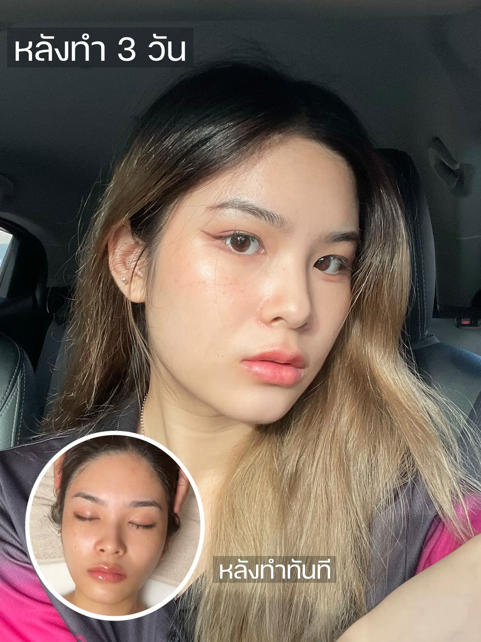 What is a withered face mask? 👀 | Non-sore Bo taut face alternative🤭 ...