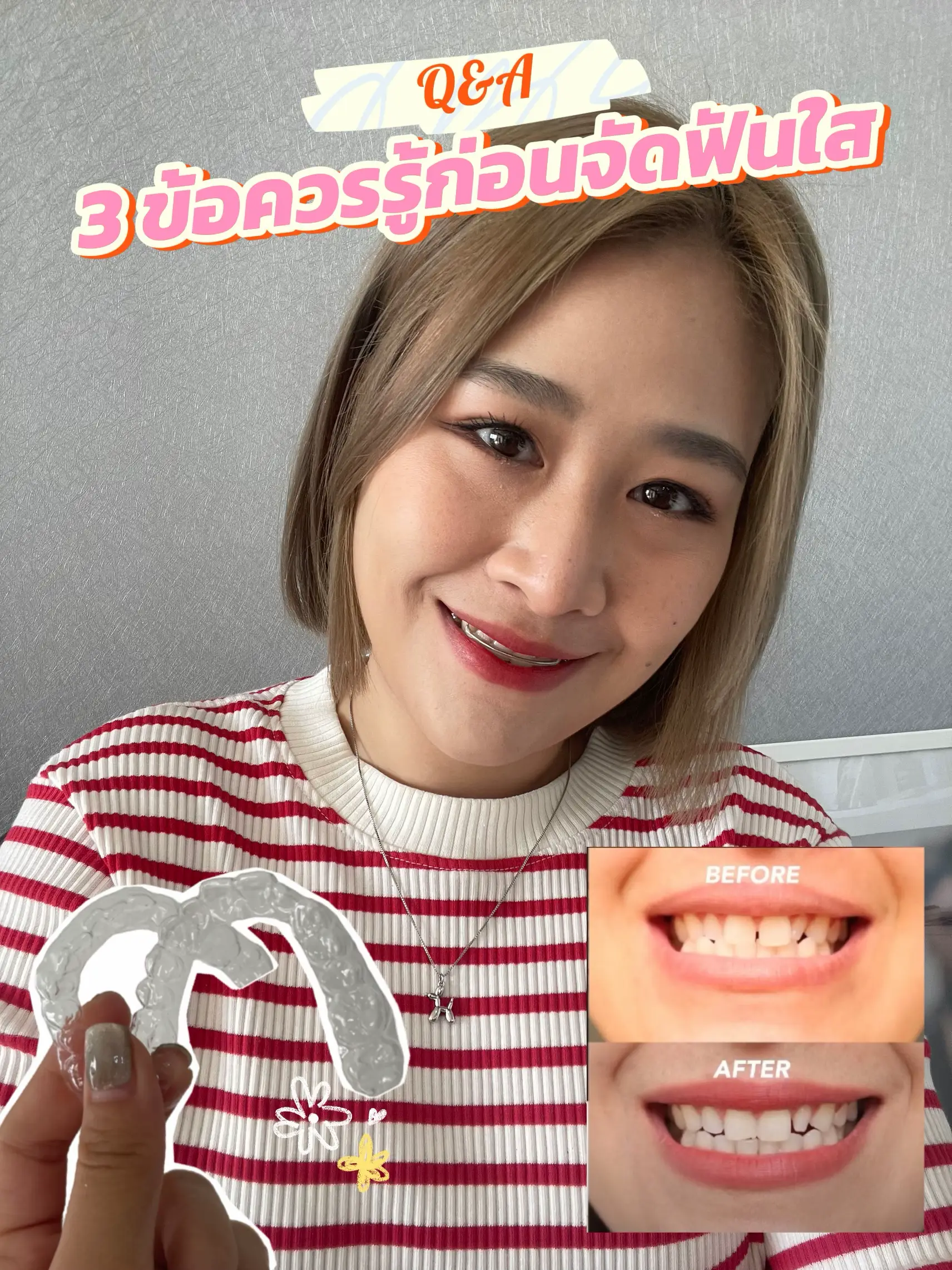 Q&A กับ 3 ข้อควรรู้ก่อนจัดฟันใส | แกลเลอรีที่โพสต์โดย RAINY Channel | Lemon8