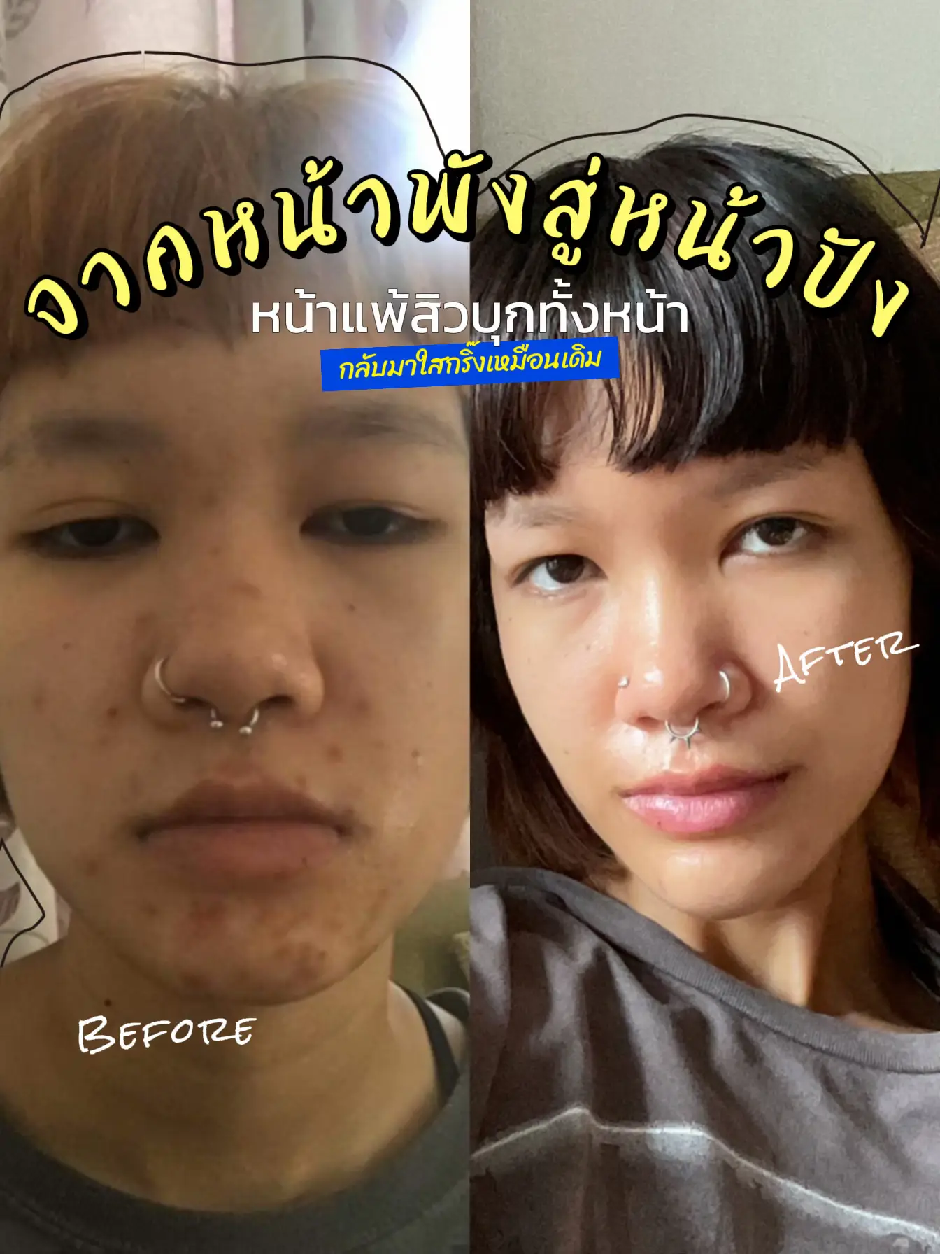 หน้าพัง😭สู่หน้าปัง🥰 | แกลเลอรีที่โพสต์โดย Bambi | Lemon8