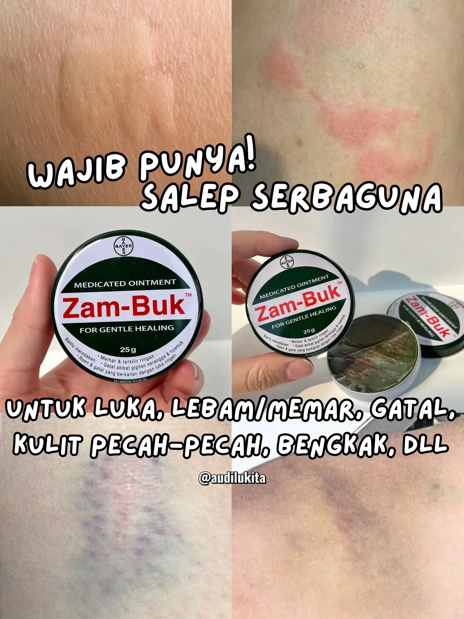 WAJIB PUNYA! SALEP SERBAGUNA (Luka, Memar, Gatal) | Galeri diposting ...