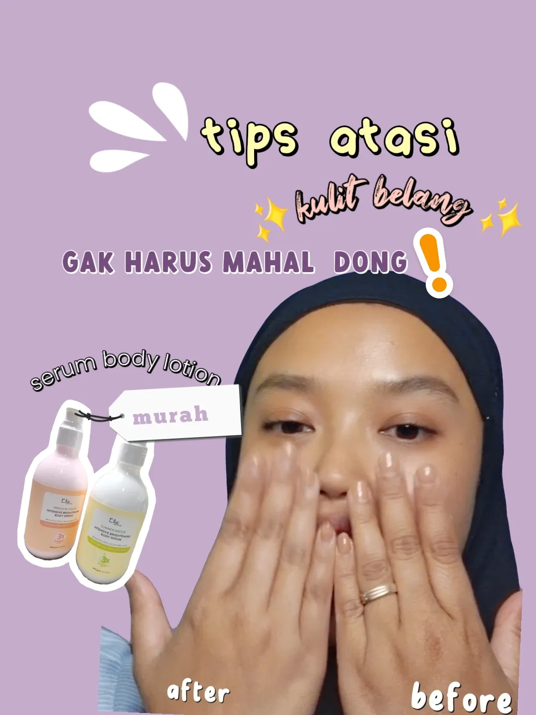 yg punya hoby traveling kulit belang gak khawatir | Galeri diposting oleh ochie | Lemon8