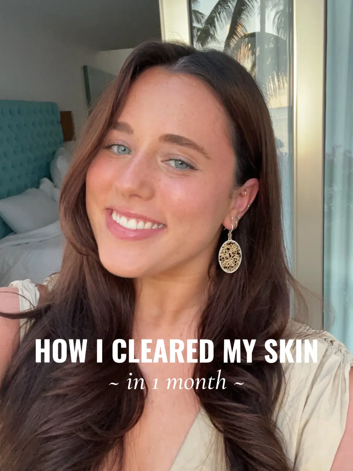 My skin transformation🙈 | Gallery posted by Ally Swartz | Lemon8