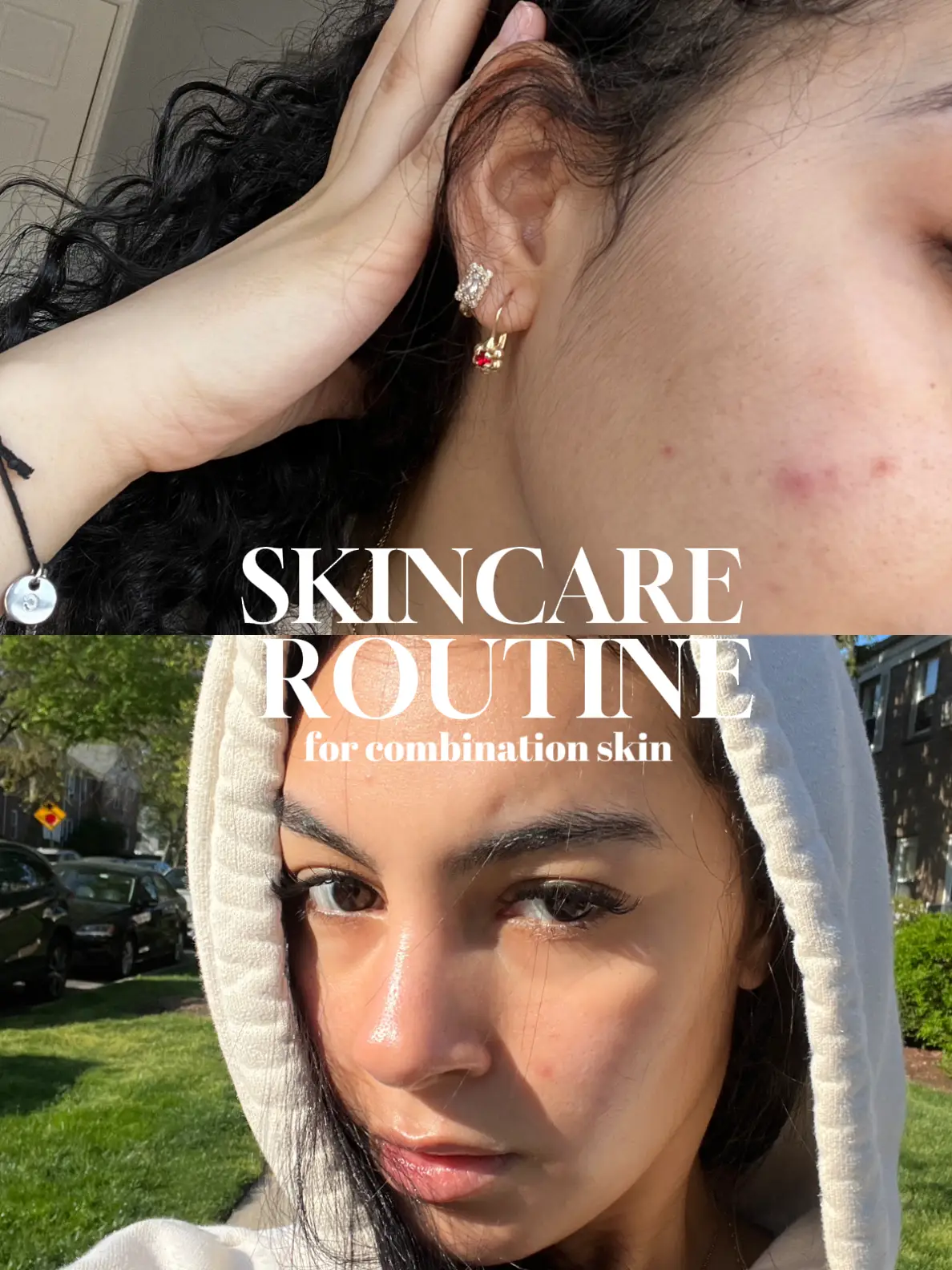 What A Combination Skin Type Needs | แกลเลอรีที่โพสต์โดย Carina | Lemon8